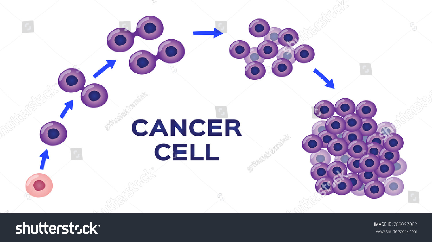 877 Cancer cell grow Images, Stock Photos & Vectors | Shutterstock