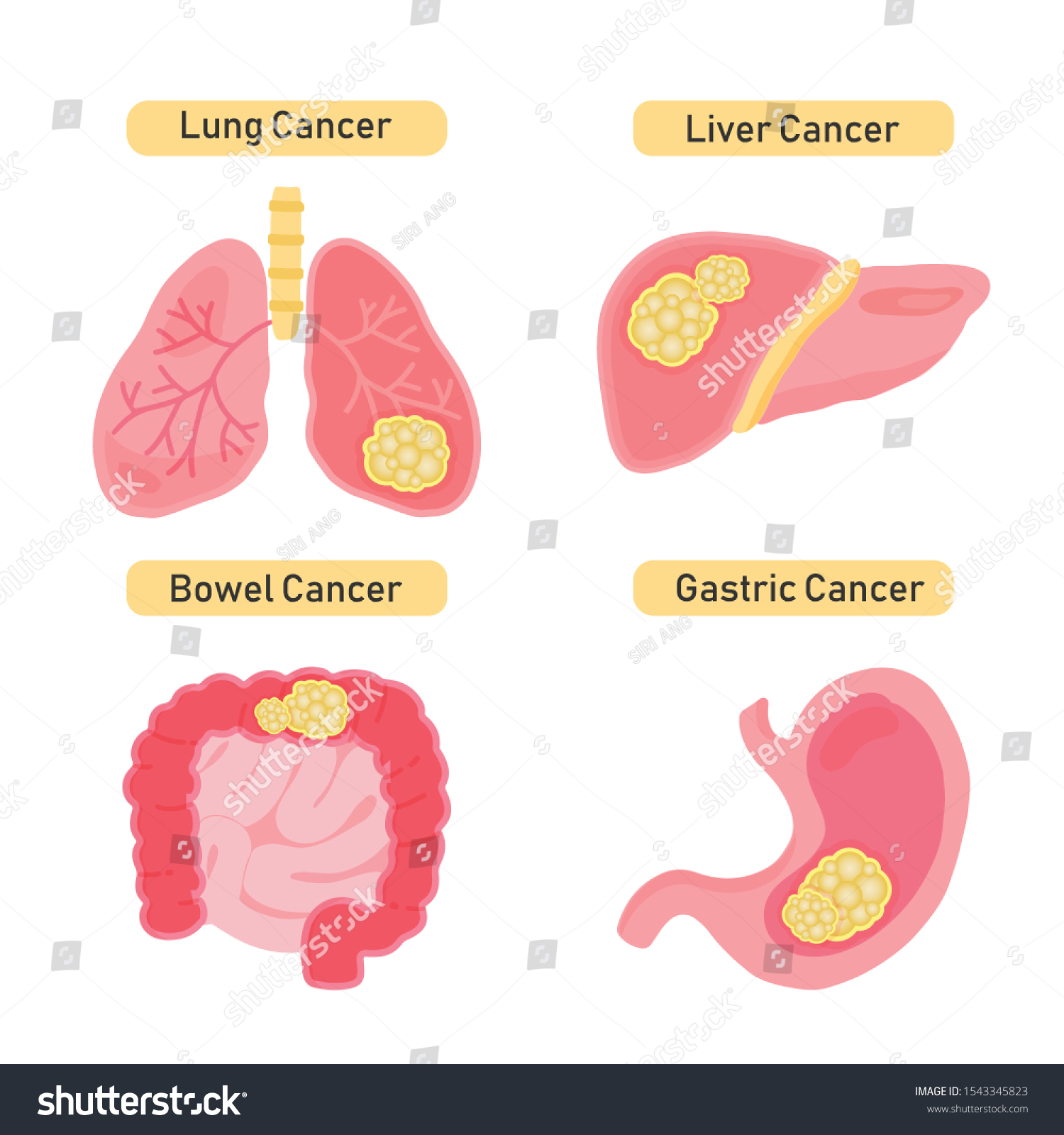 Cancer Types Flat Vector Illustration Stock Vector (Royalty Free ...