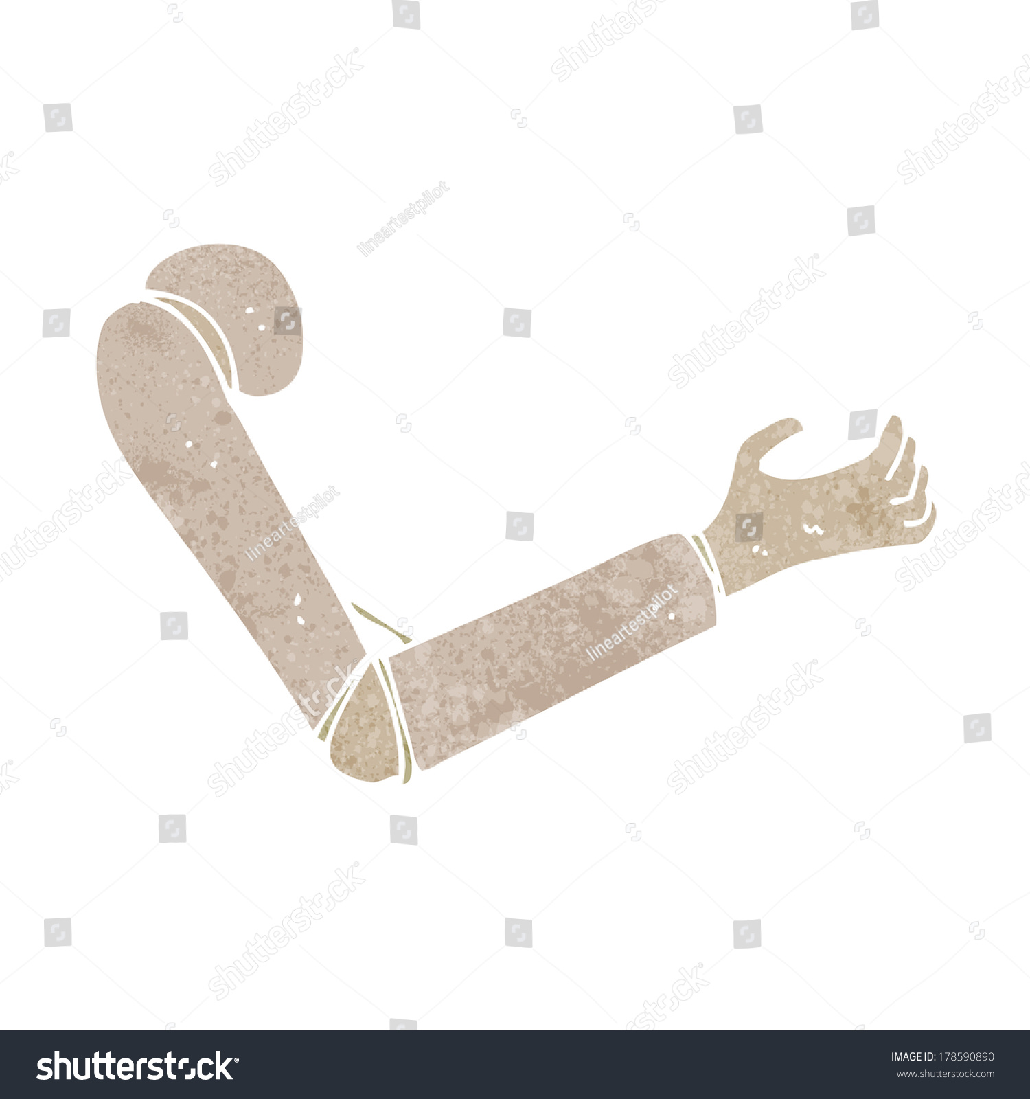 Cartoon Prosthetic Arm Stock Vector (Royalty Free) 178590890