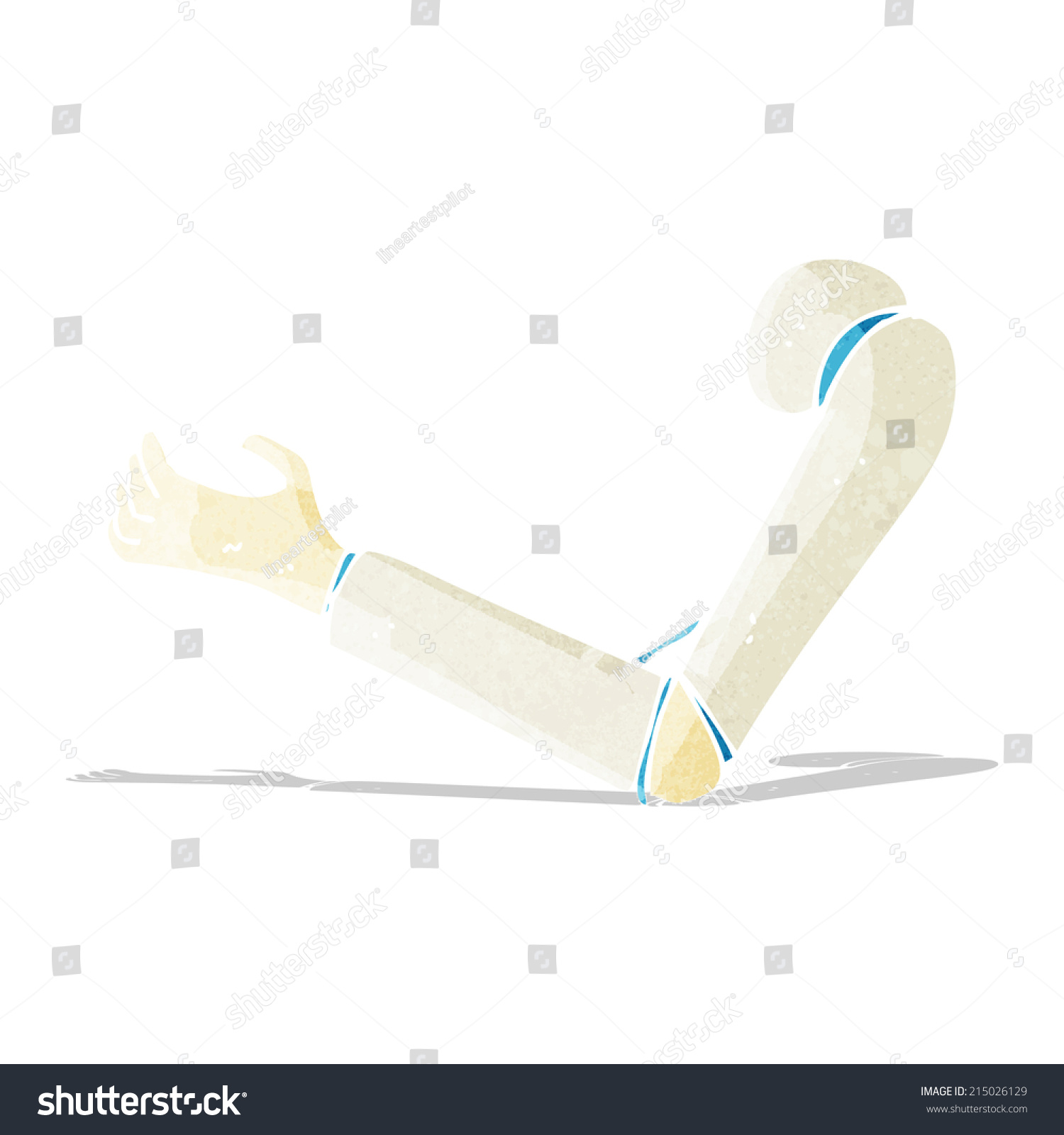 Cartoon Prosthetic Arm Stock Vector (Royalty Free) 215026129 | Shutterstock