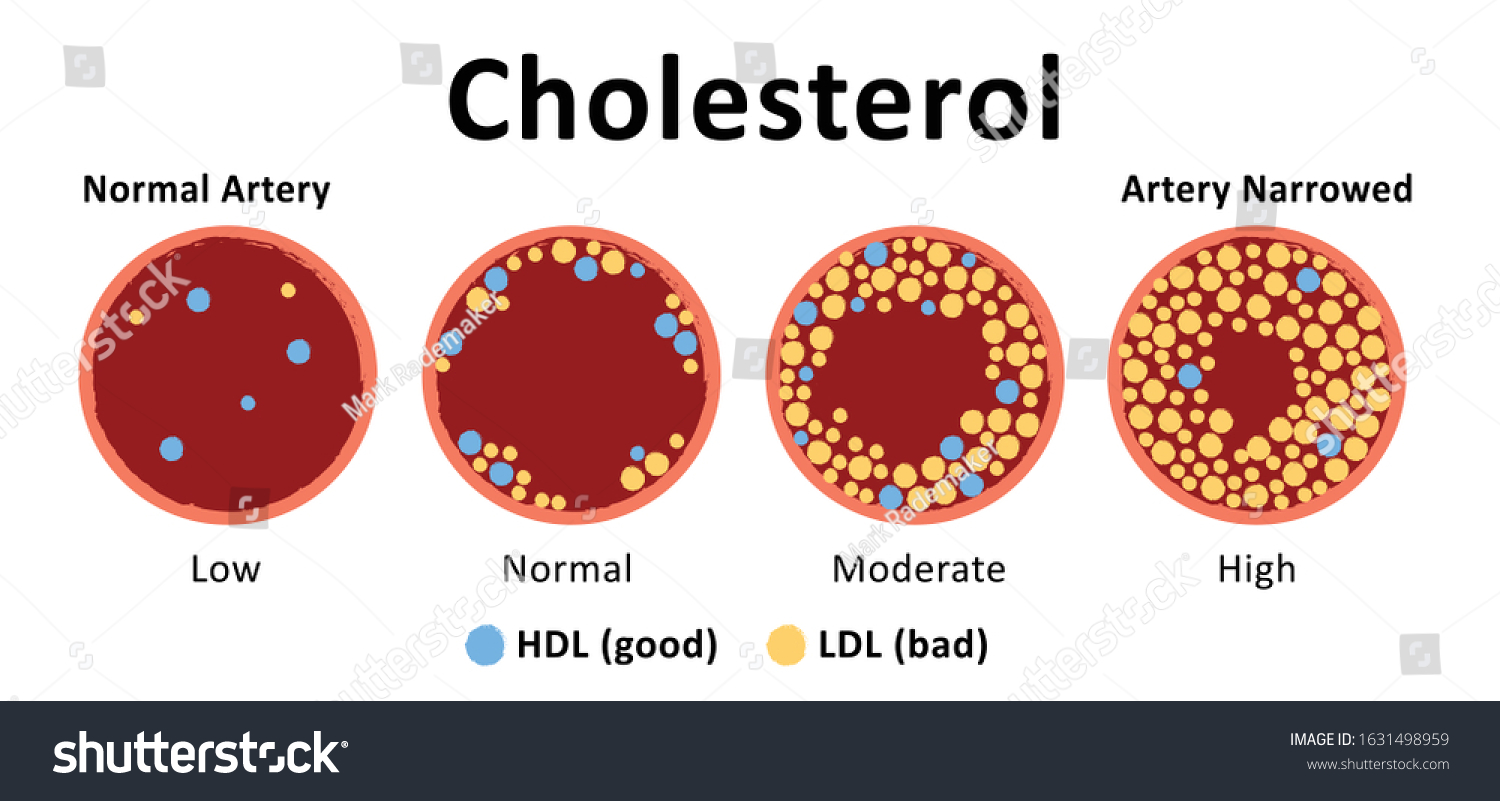 Cholesterol hdl ldl Images, Stock Photos & Vectors | Shutterstock Cholesterol hdl ldl Images, Stock Photos & Vectors | Shutterstock
