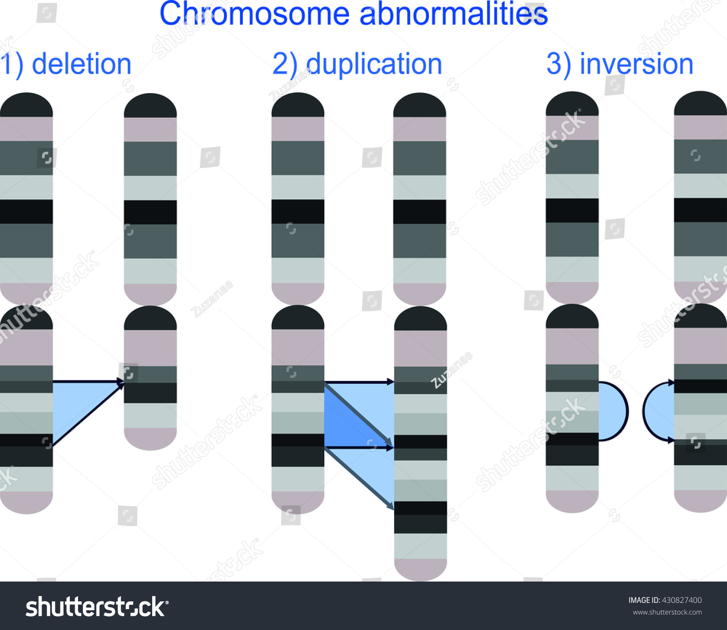 Chromosome Abnormalities Deletion Duplication Inversion: vector de ...