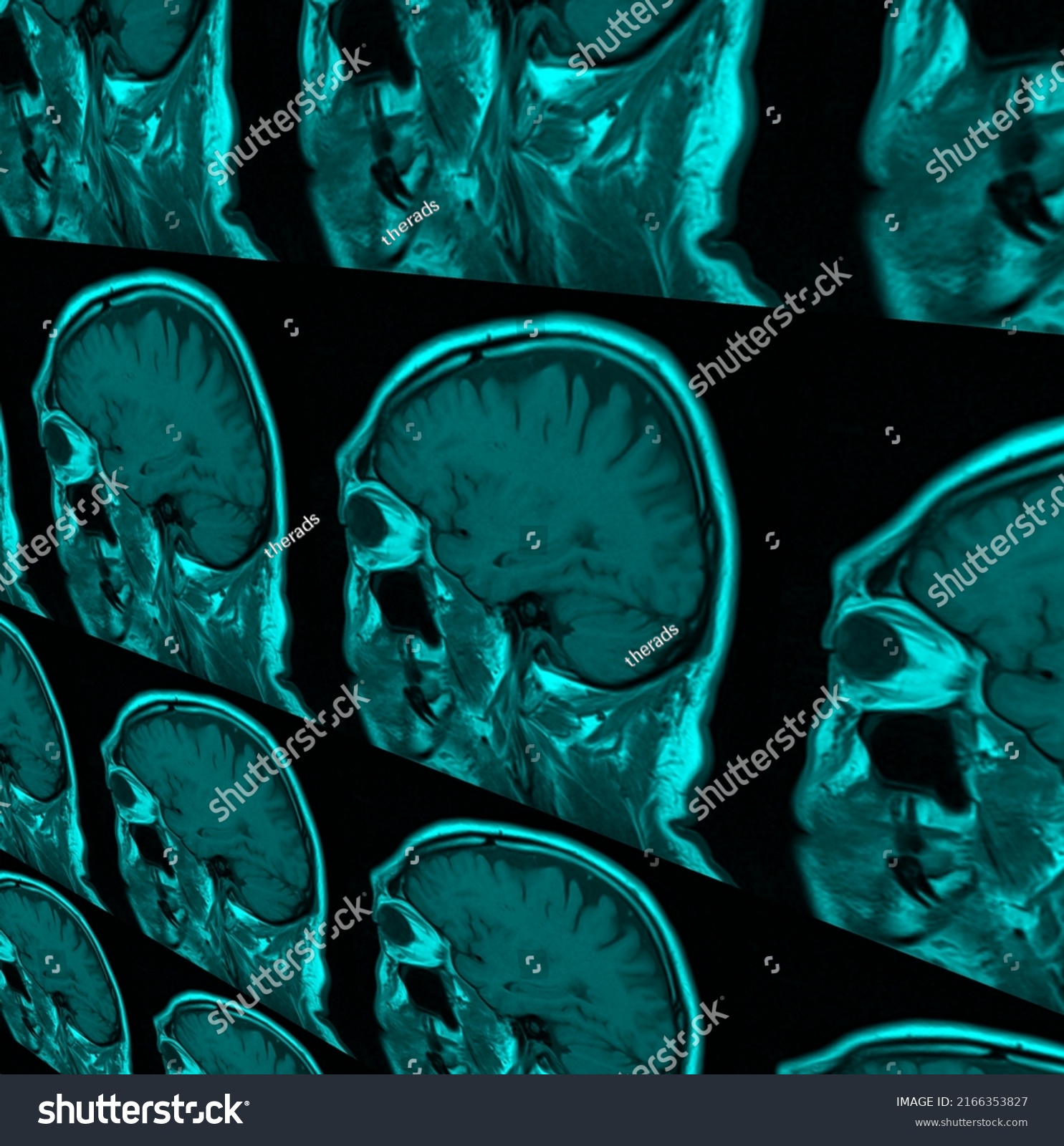 Colored Sagital Brain Mri Vector Background Stock Vector (Royalty Free ...