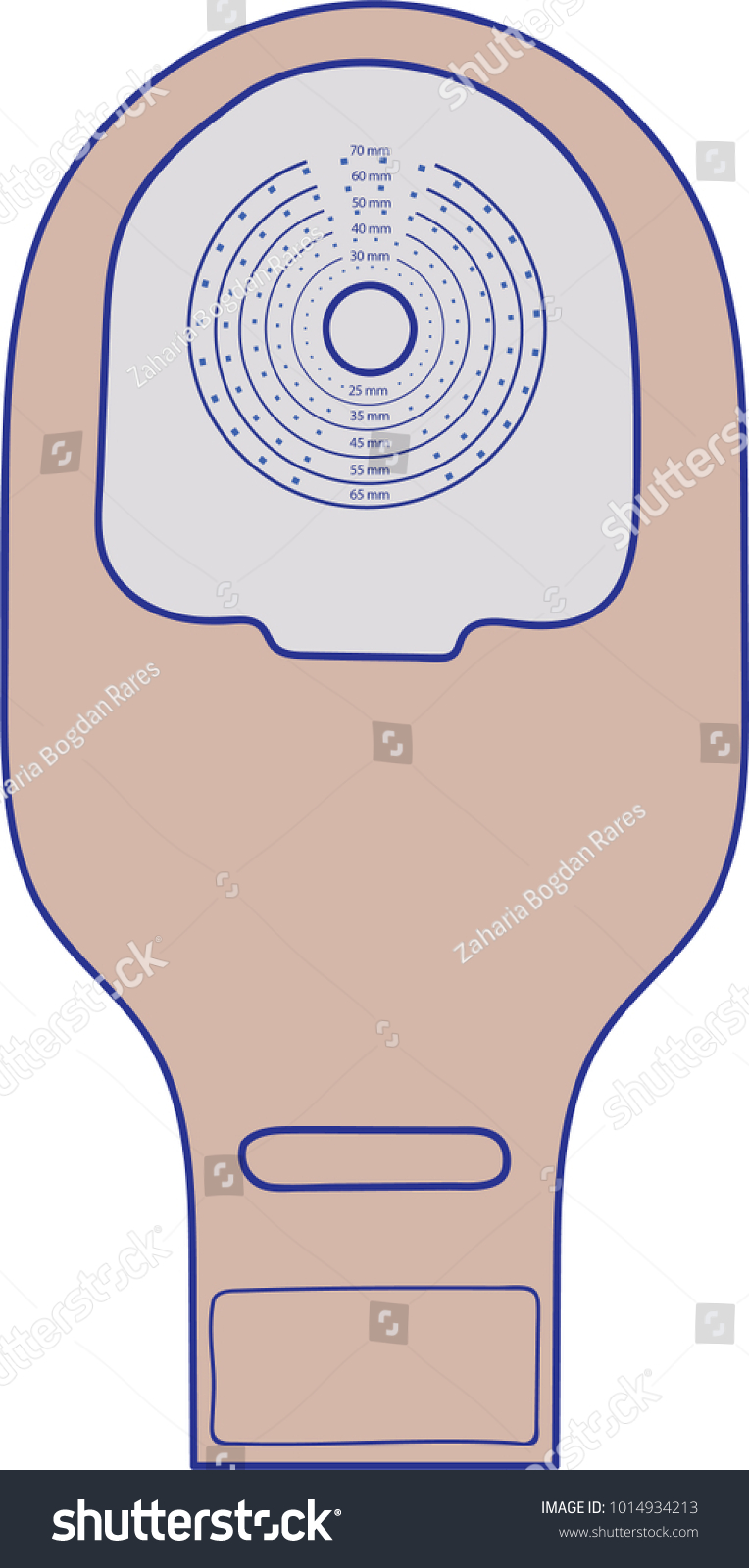 Colostomy Bag Stoma Vector: เวกเตอร์สต็อก (ปลอดค่าลิขสิทธิ์) 1014934213 ...