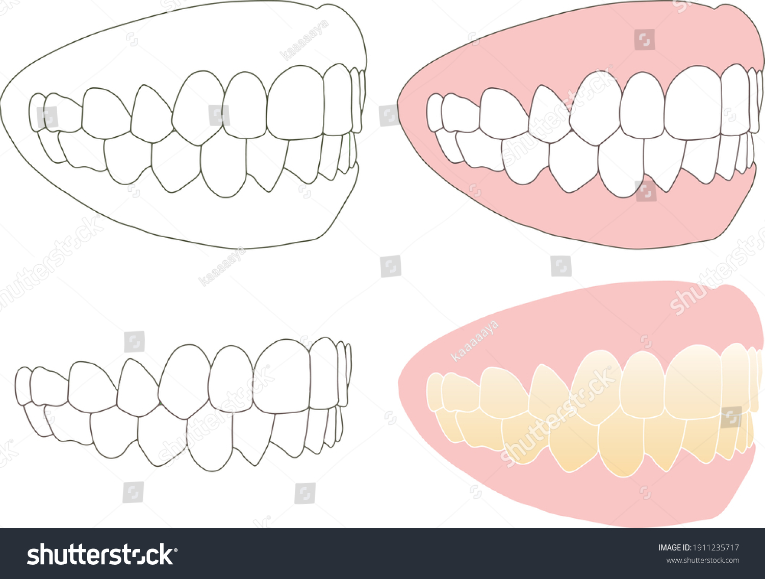 Correct Sideways Tooth Alignment Set Illustration: เวกเตอร์สต็อก (ปลอด ...