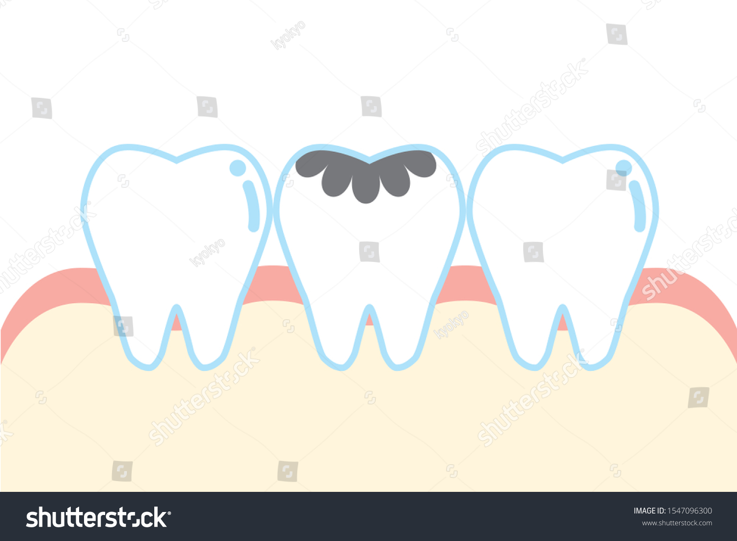 Cute Cartoon Decayed Tooth Illustration Stock Vector (Royalty Free ...