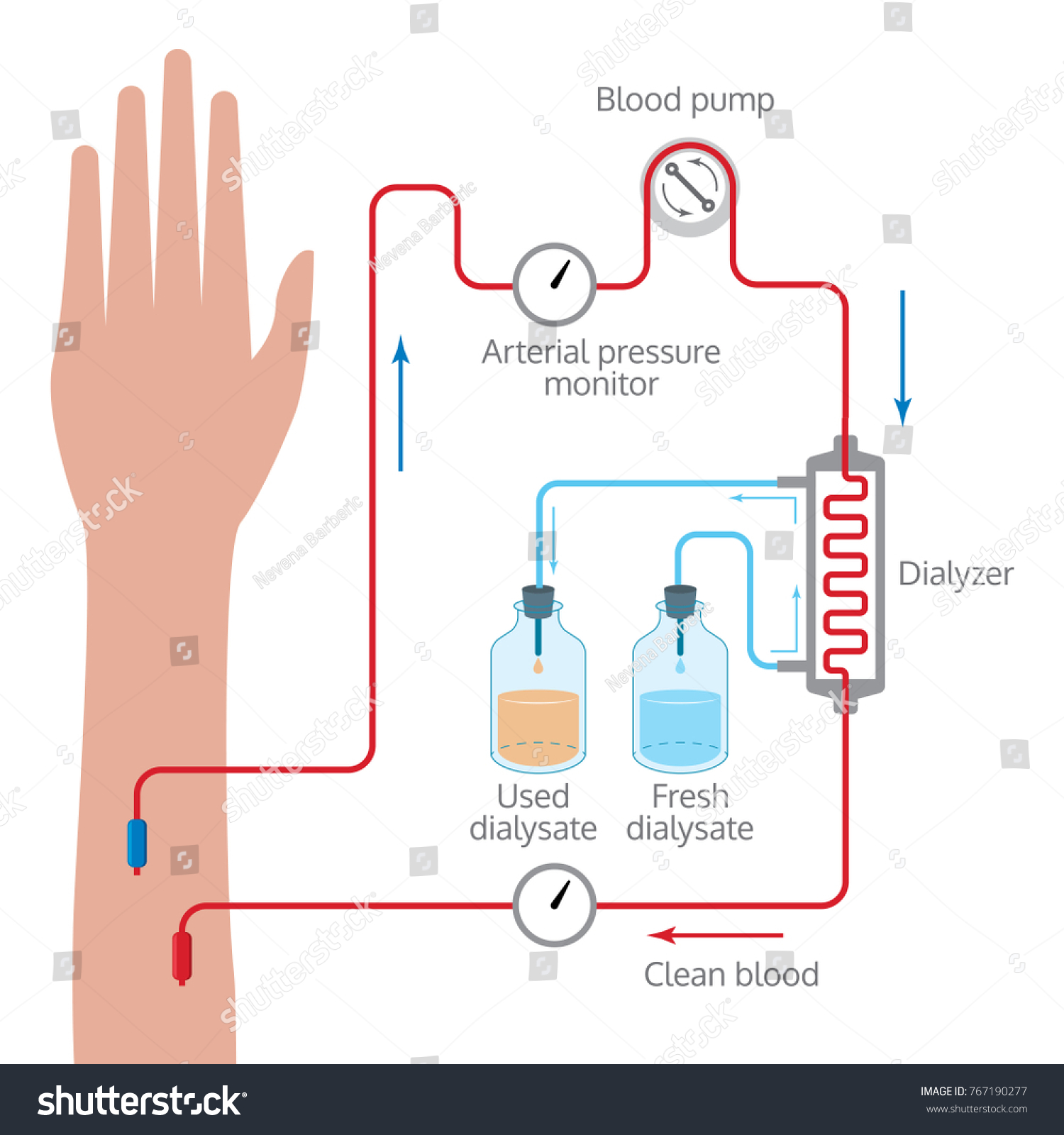 Dialysis Process Illustration Stock Vector (Royalty Free) 767190277 ...