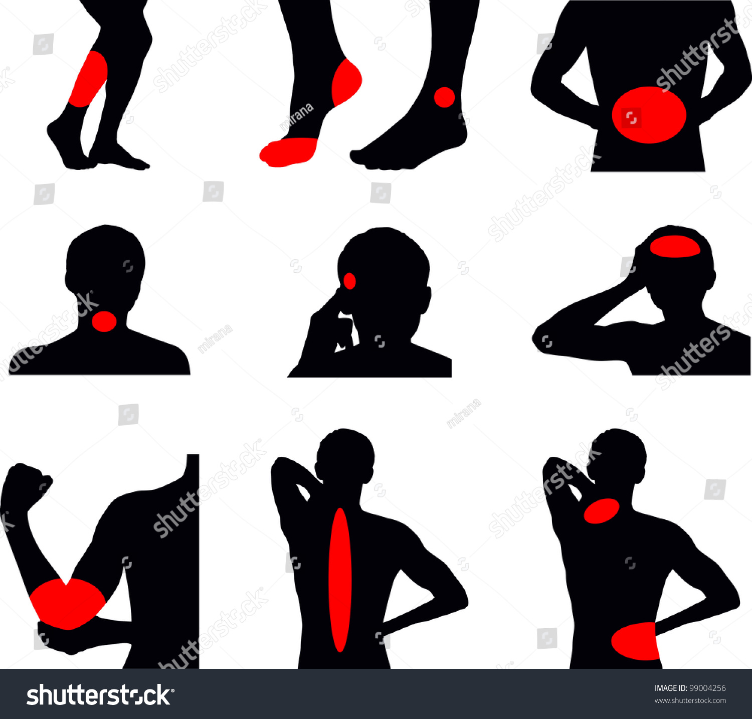Disease Vector Red Stock Vector (Royalty Free) 99004256