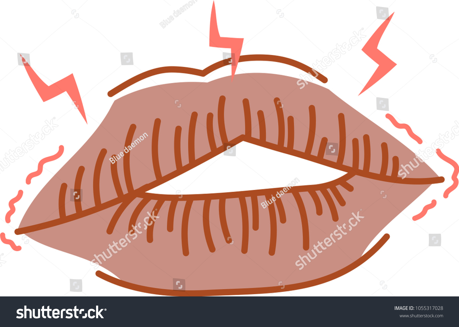Dry Ugly Lips: เวกเตอร์สต็อก (ปลอดค่าลิขสิทธิ์) 1055317028 | Shutterstock