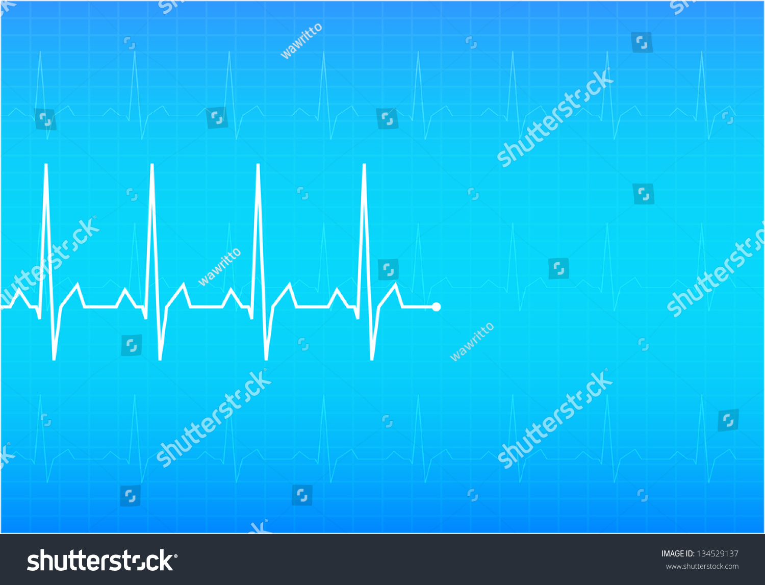 Ecg Electrocardiogram Blue Vector Illustration Stock Vector (Royalty ...