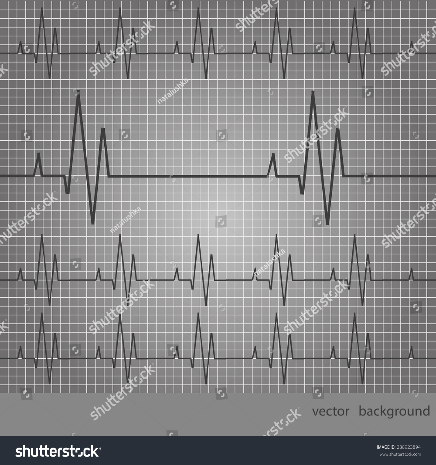 Ecg Tracing Chart On Gray Background Stock Vector (Royalty Free) 288923894