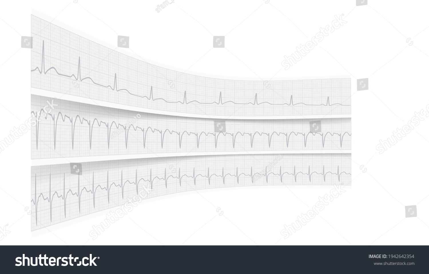 Ecg Waves On Paper Realistic Drawing Stock Vector (Royalty Free ...