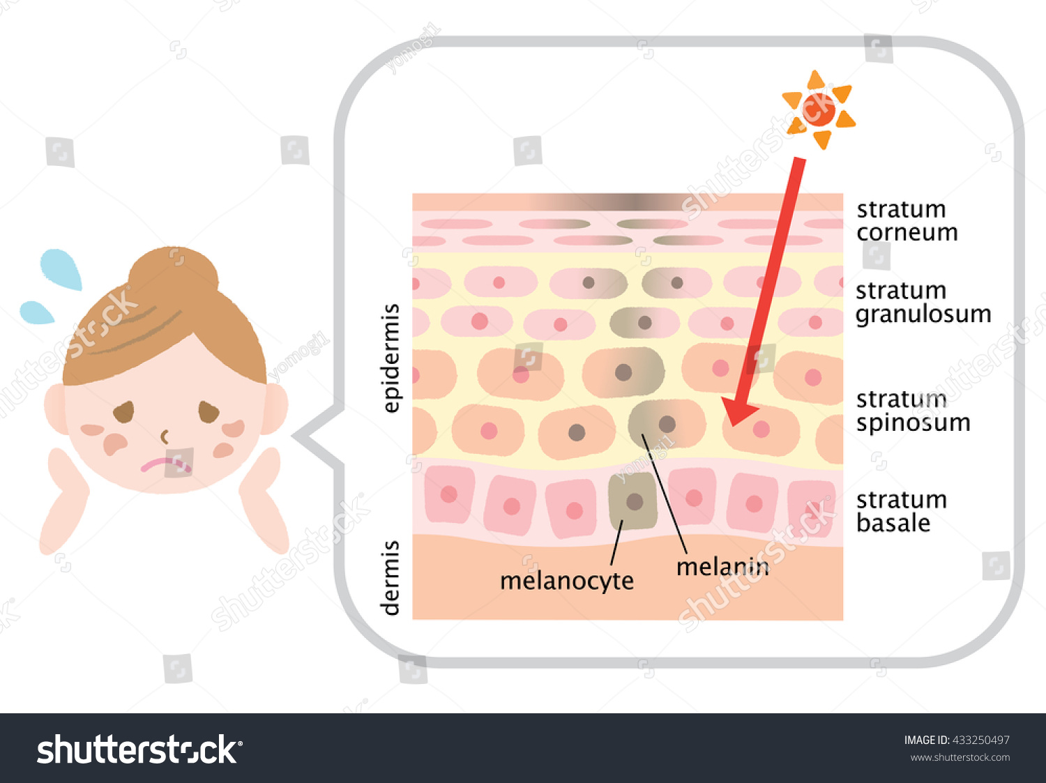 Facial Blotches And Skin Mechanism Stock Vector 433250497 : Shutterstock Facial Blotches And Skin Mechanism Stock Vector 433250497 : Shutterstock