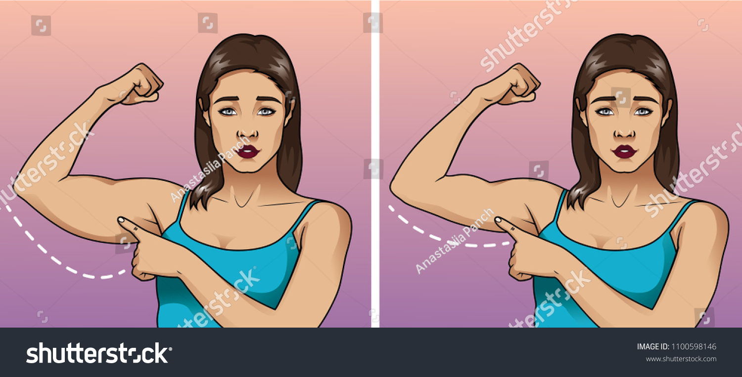 10,914 Female fat arms Images, Stock Photos & Vectors | Shutterstock