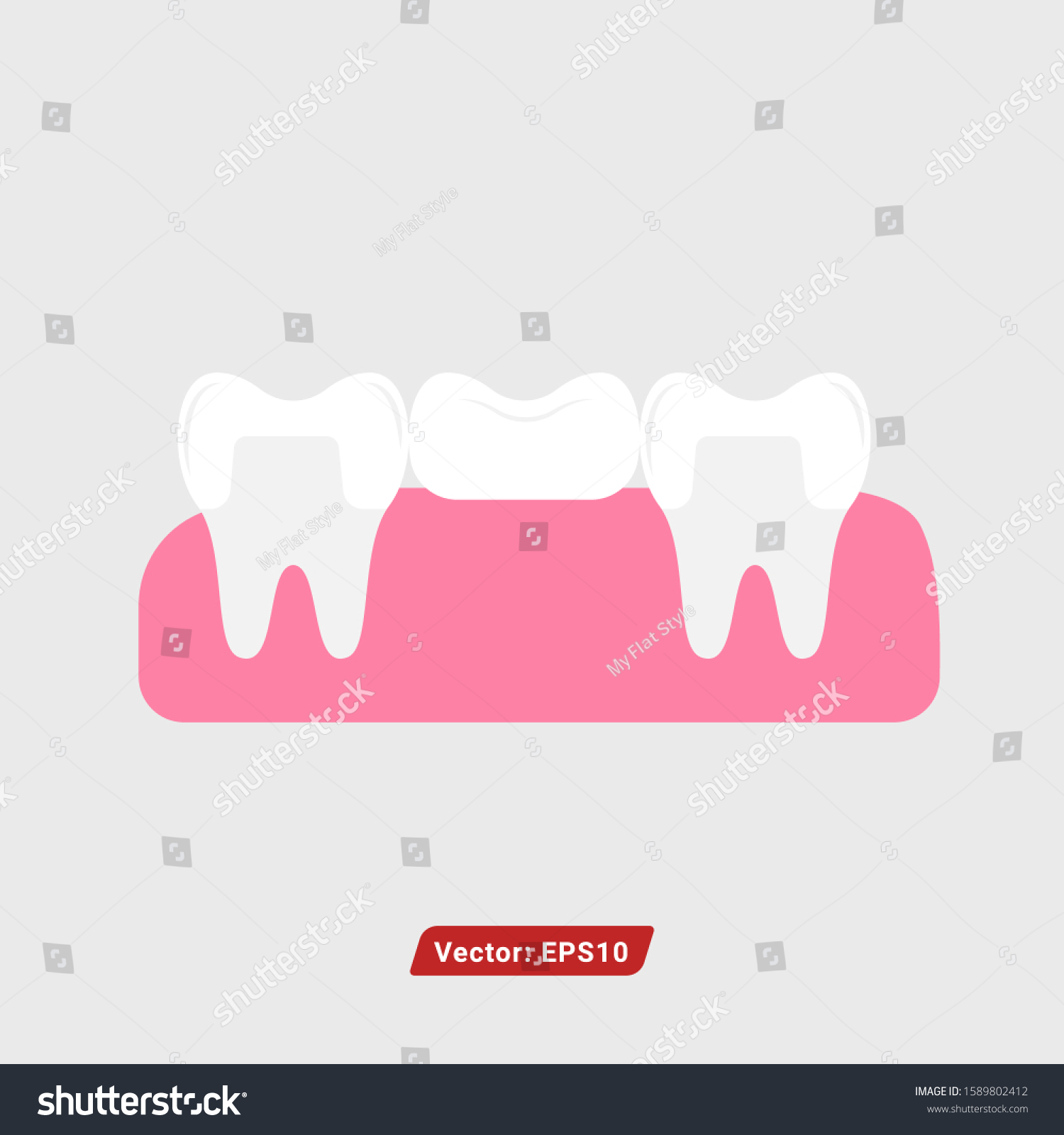Fix Denture Vector Illustration Flat Style Stock Vector (Royalty Free ...