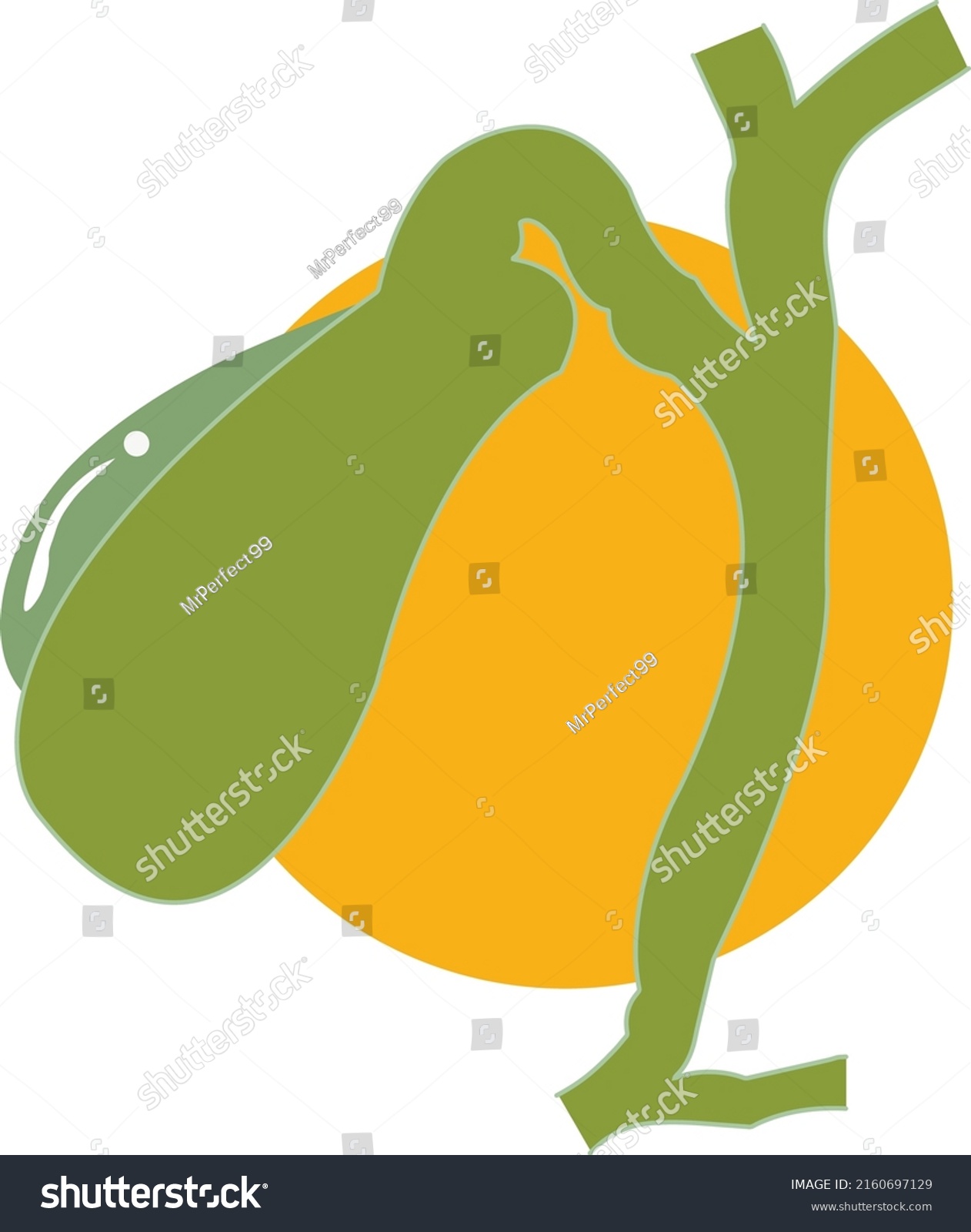 Gallbladder Gallstones Biliary Tree Vector Art Stock Vector (Royalty ...