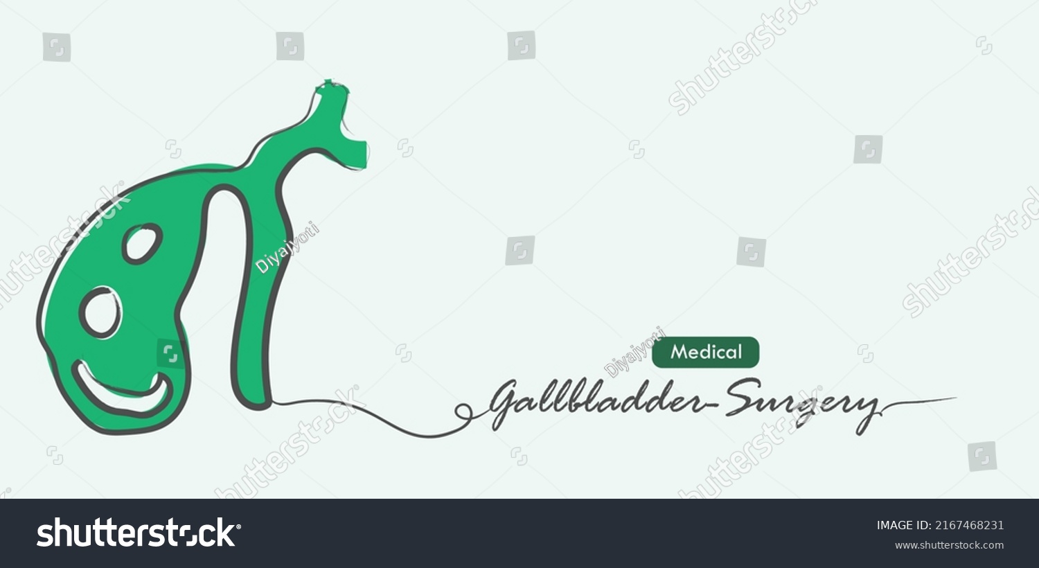 Gallbladder Surgery Icon Line Art Design Stock Vector (Royalty Free ...