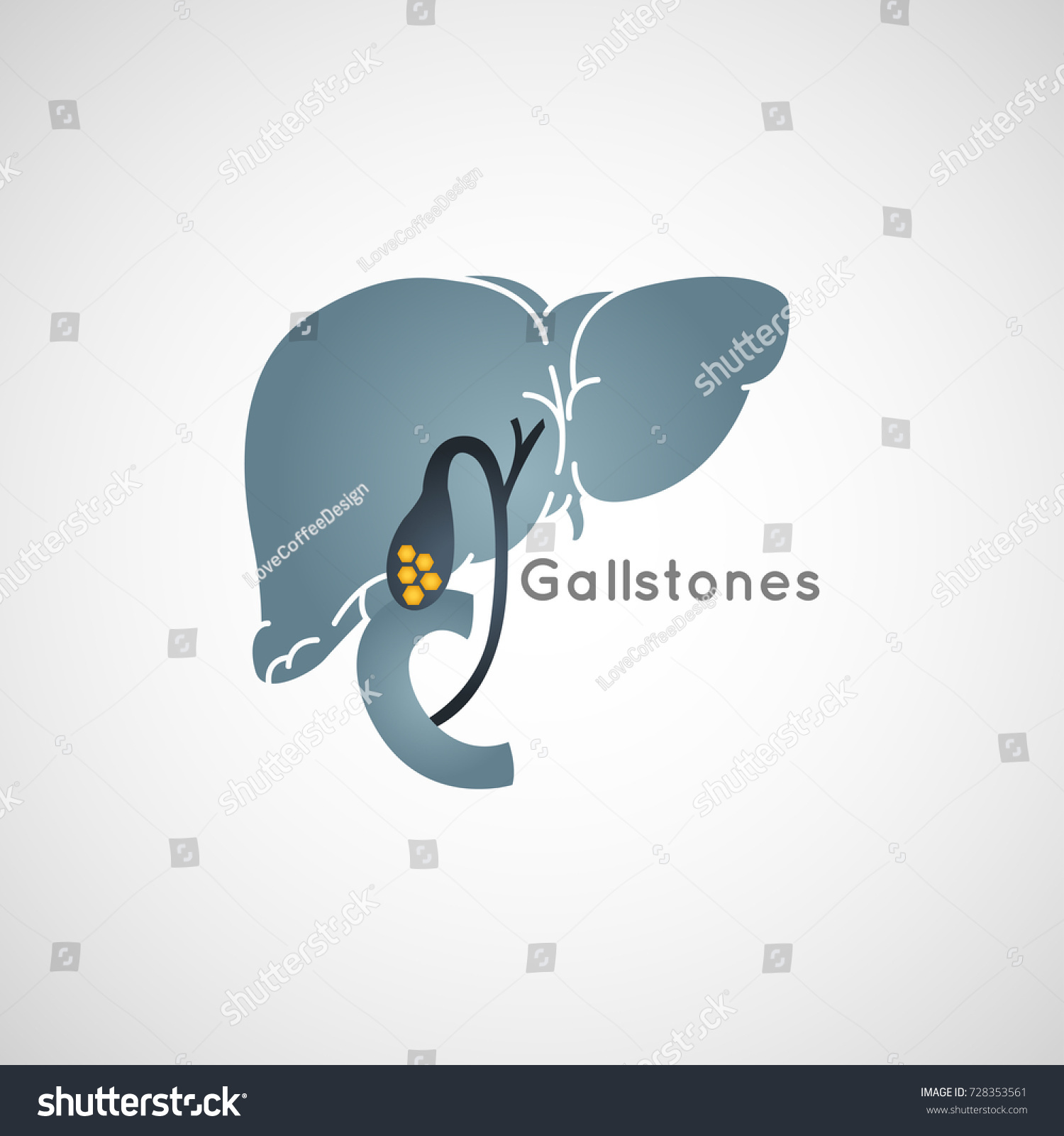1,568 Gall bladder stones Images, Stock Photos & Vectors | Shutterstock