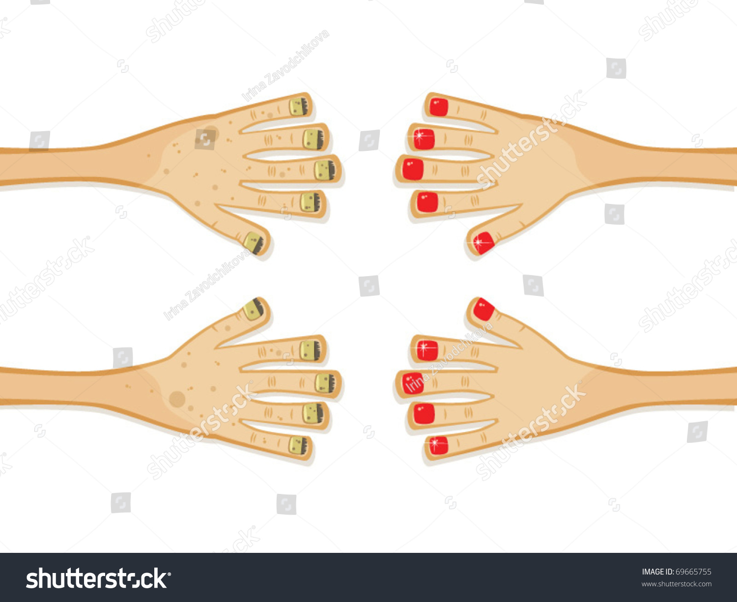 Hands Before After Manicure Comic Vector 库存矢量图（免版税）69665755 | Shutterstock