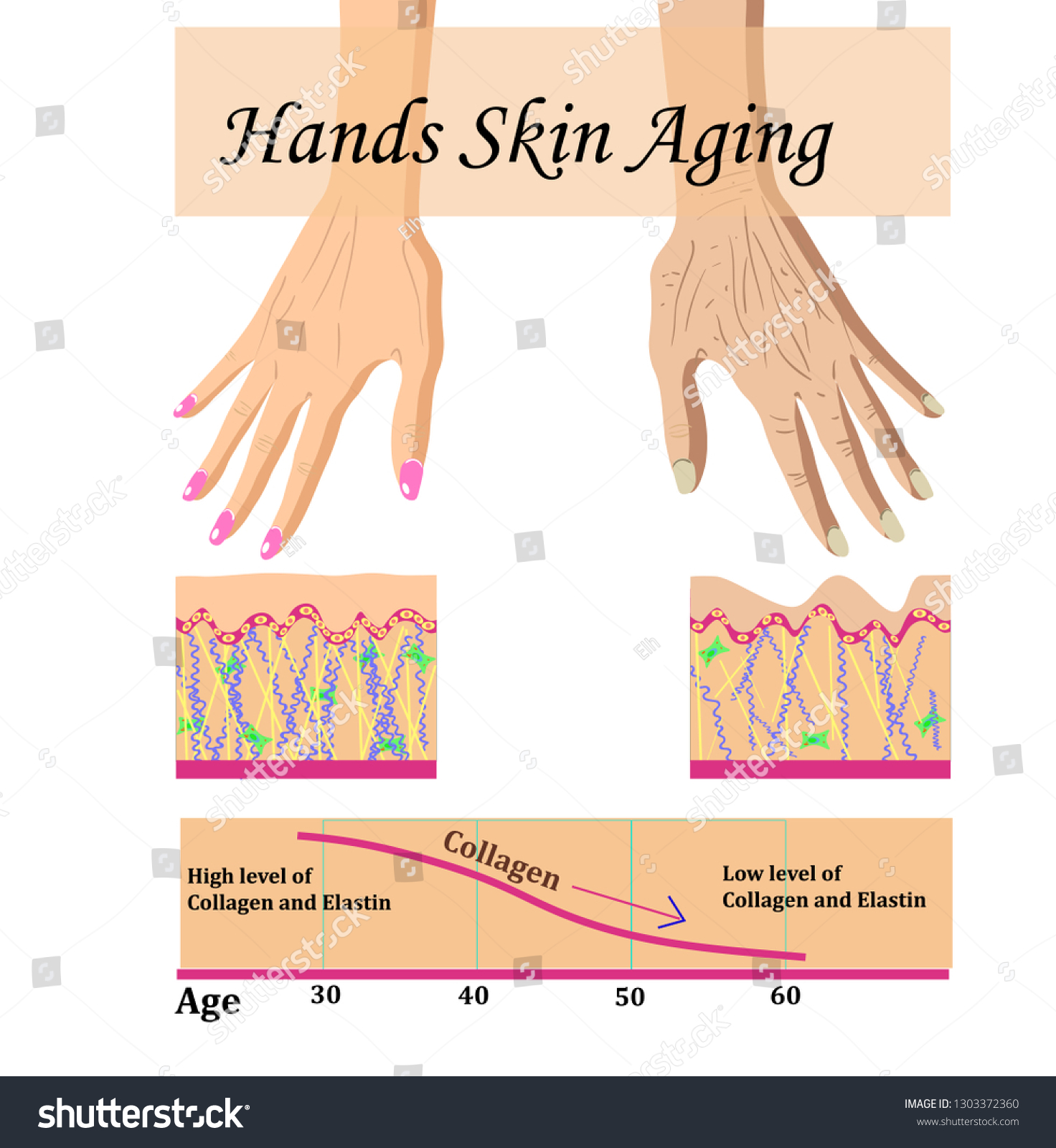 Hands Skin Aging Vector Illustration Chart: стоковая векторная графика ...
