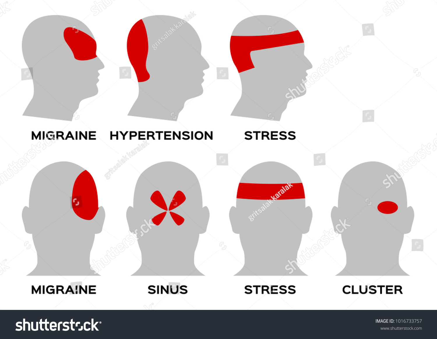3,450 Types of headaches Images, Stock Photos & Vectors | Shutterstock