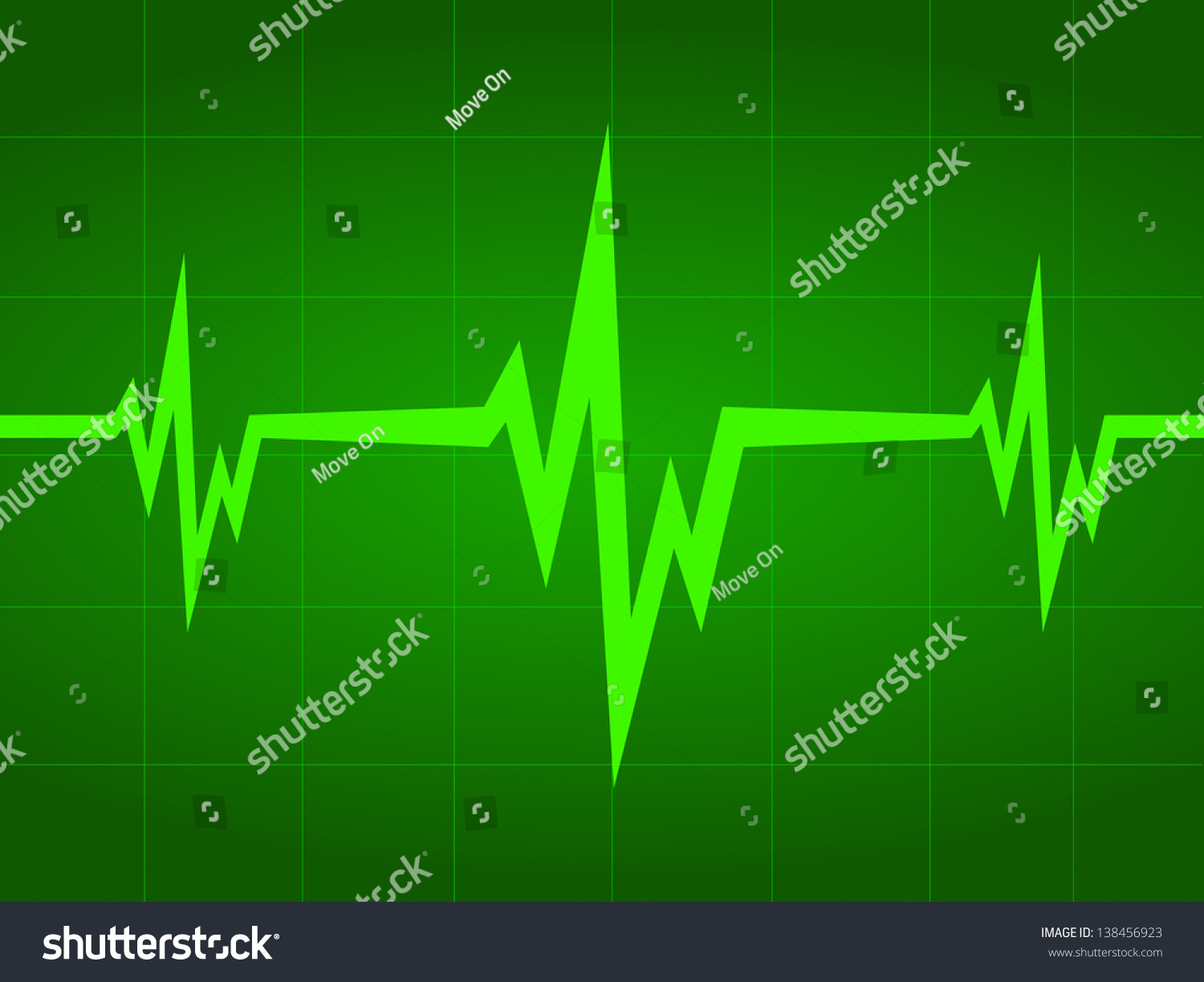 Heart Beat Ekg Graph Stock Vector (Royalty Free) 138456923