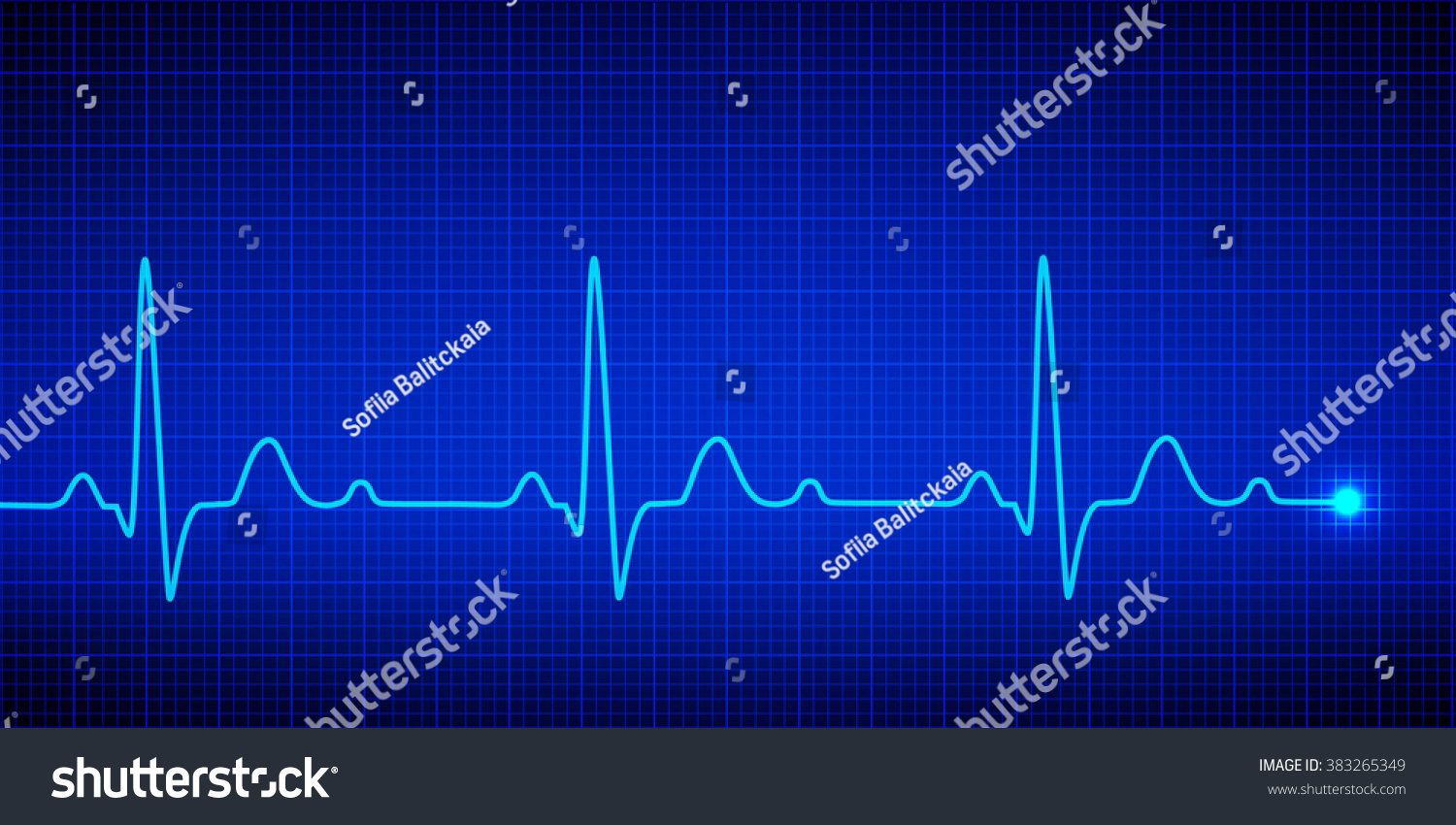 2.164 Normal heart beat Gambar, Foto Stok & Vektor | Shutterstock