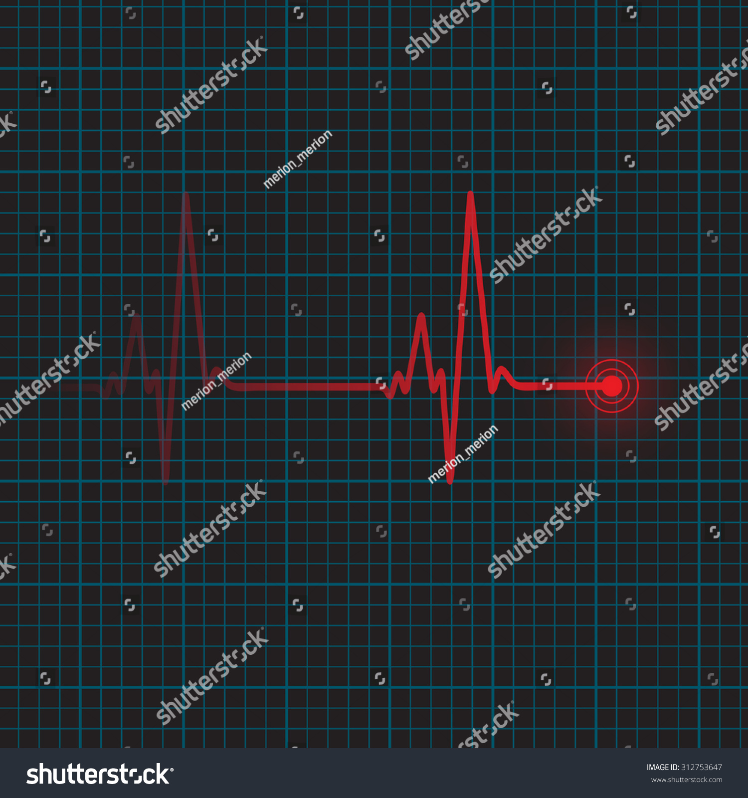 Heartbeat Vector Illustration Stock Vector (Royalty Free) 312753647 ...