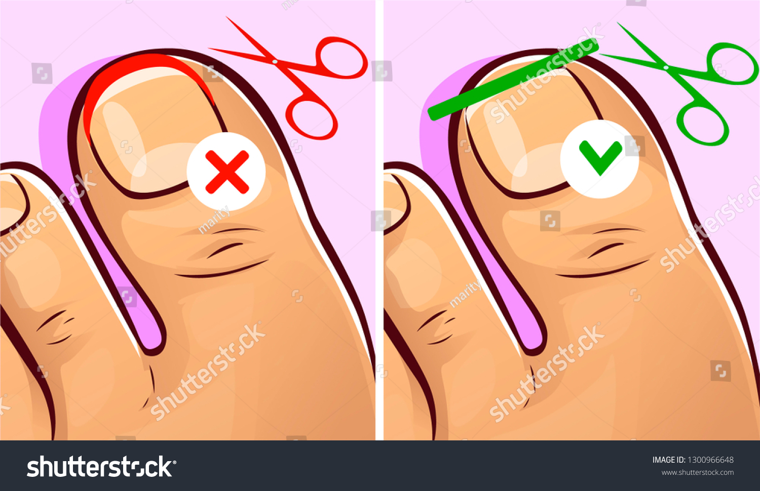 How Cut Nails Vector Illustration Stock Vector (Royalty Free) 1300966648