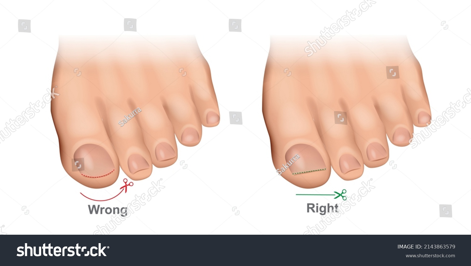 How Cut Toenails Correctly Vector Illustration Stock Vector Royalty Free 2143863579 Shutterstock