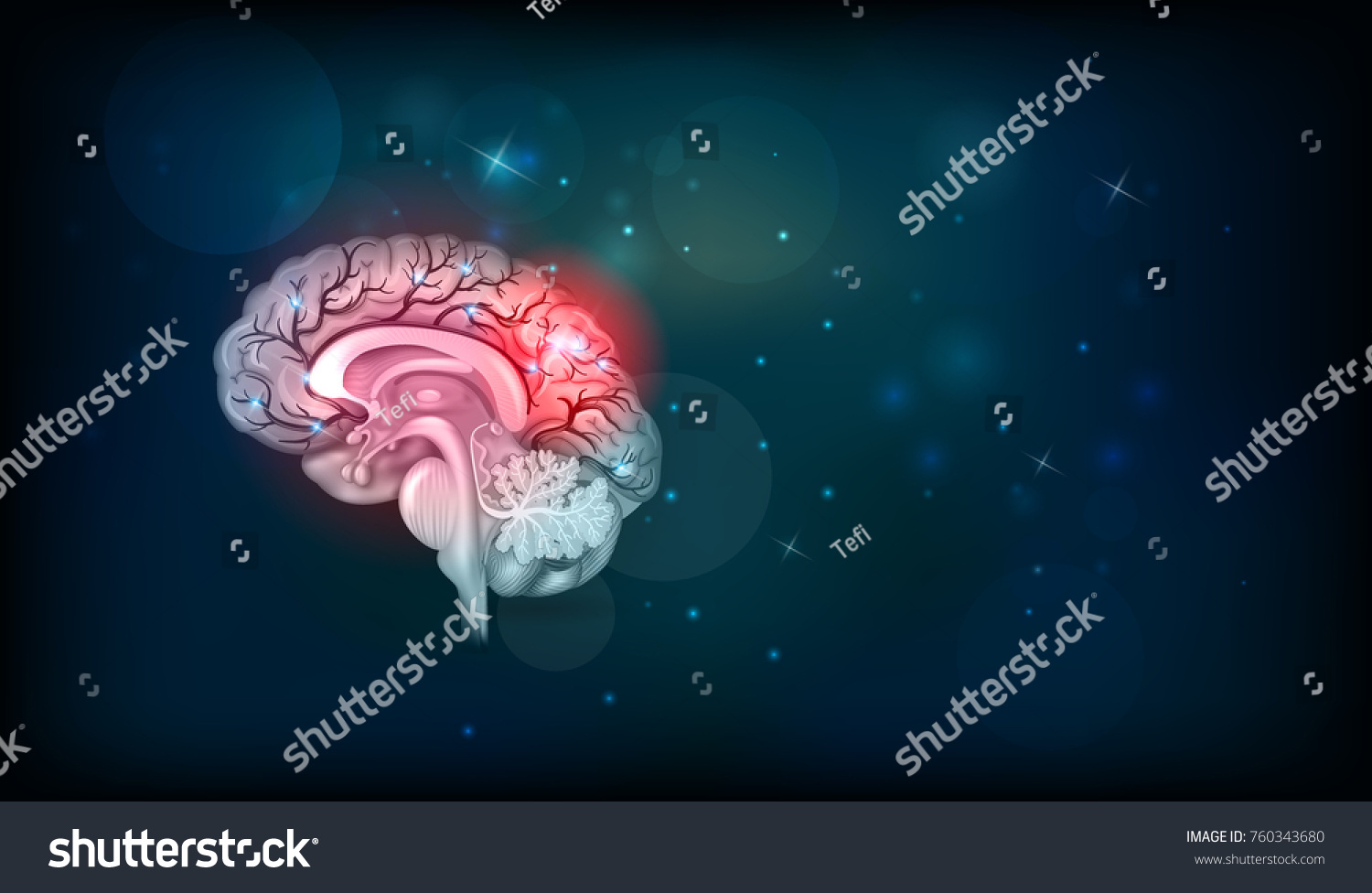Human Brain Problems Abstract Dark Background Stock Vector (Royalty ...