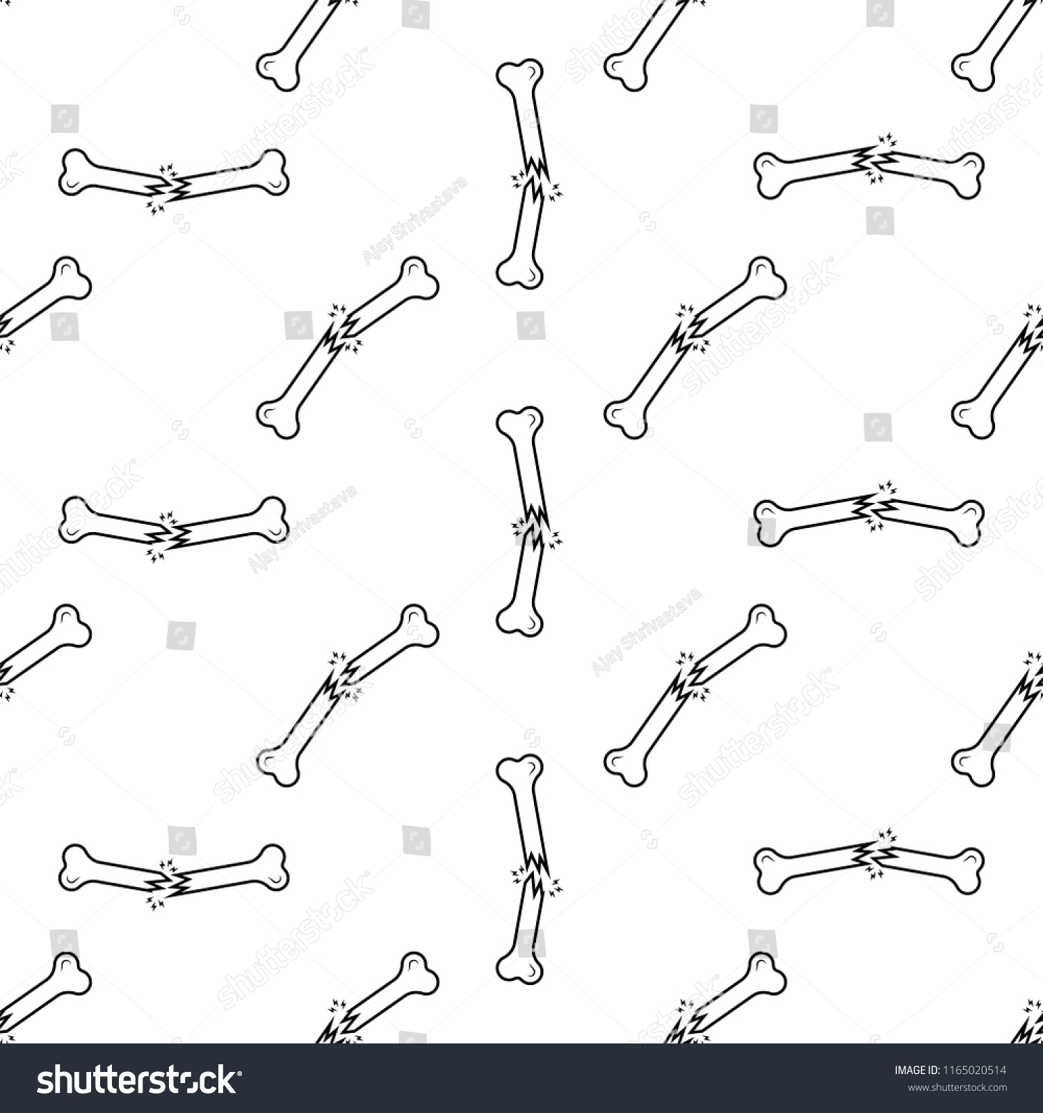 Human Broken Bone Bone Fracture Seamless Stock Vector (Royalty Free ...