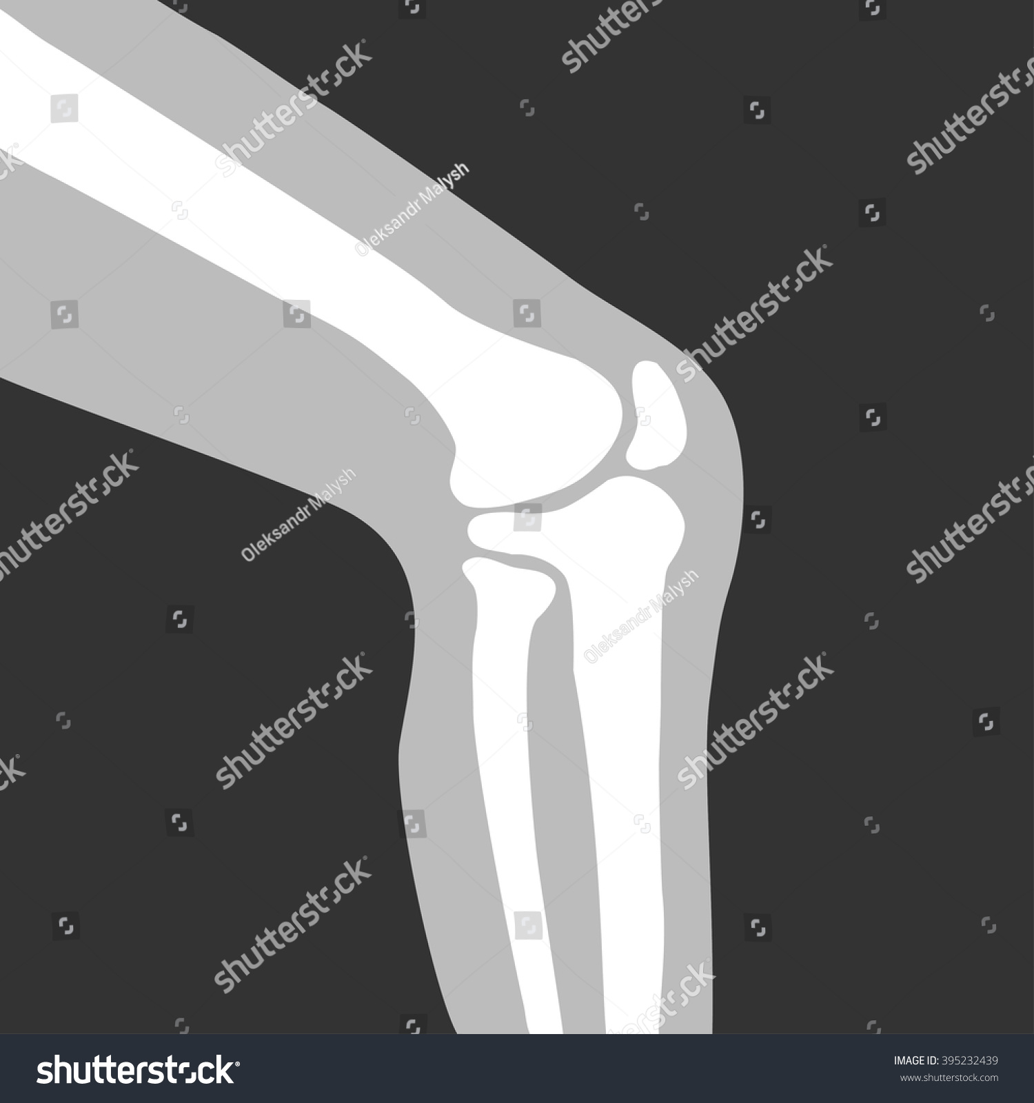 Human Knee Joint Side View Vector: เวกเตอร์สต็อก (ปลอดค่าลิขสิทธิ์ ...