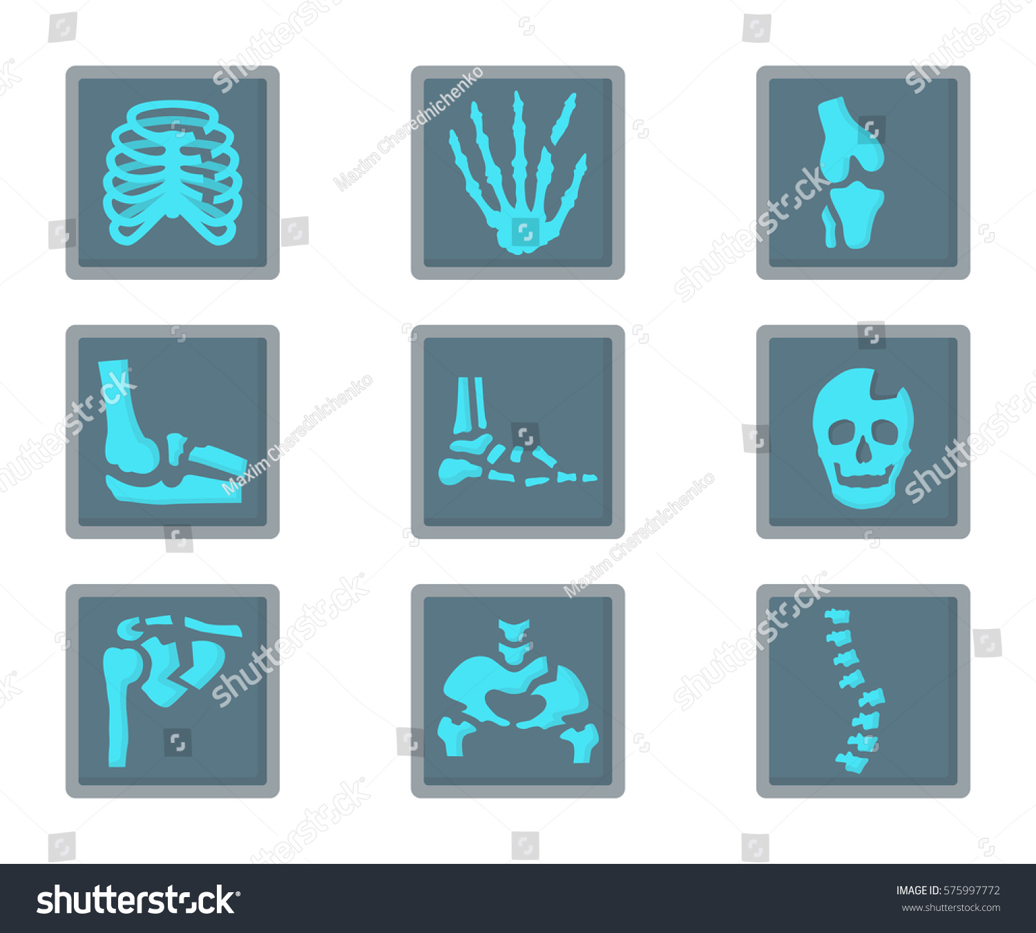 Vektor Stok Human Skeleton Broken Bone Xray Flat (Tanpa Royalti ...