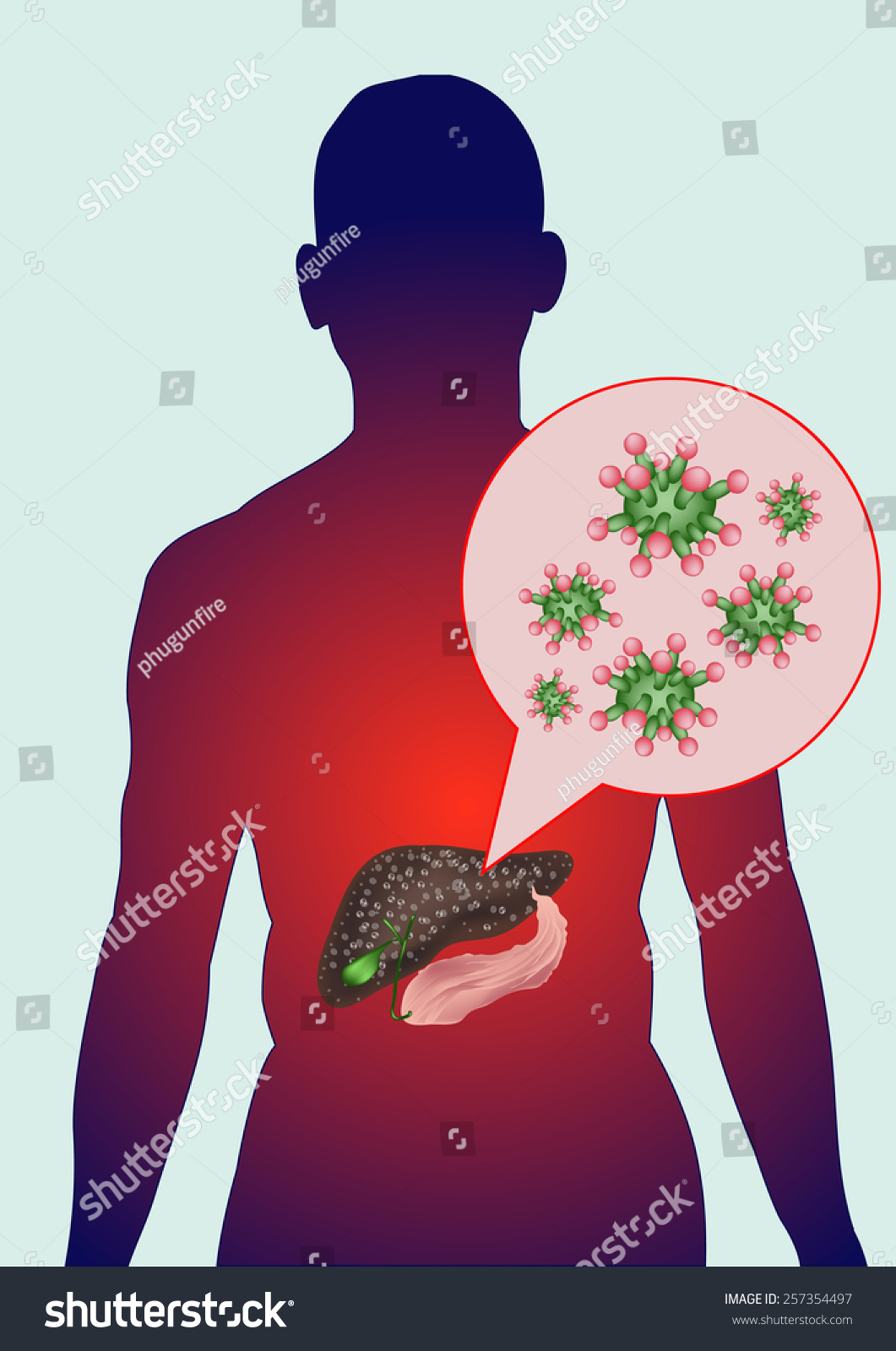 2 Enlargement of cervical lymph nodes vector Images, Stock Photos ...