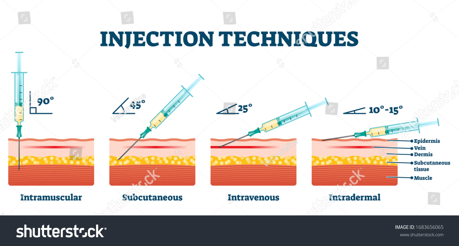 1,344 Injection technique Images, Stock Photos & Vectors | Shutterstock