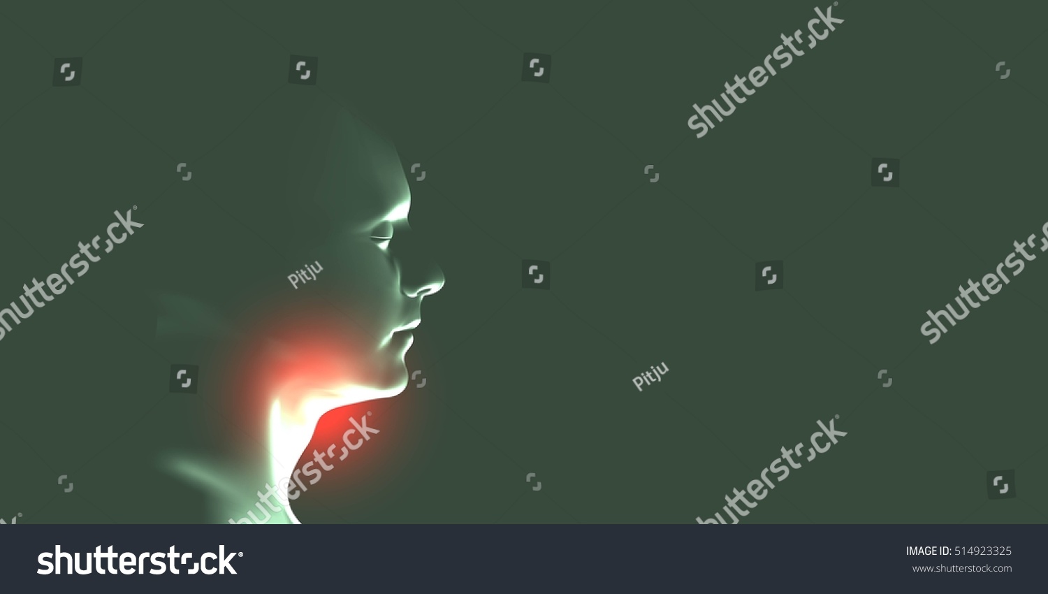 Laryngitis Vector Illustration Human Throat Irritation Stock Vector ...