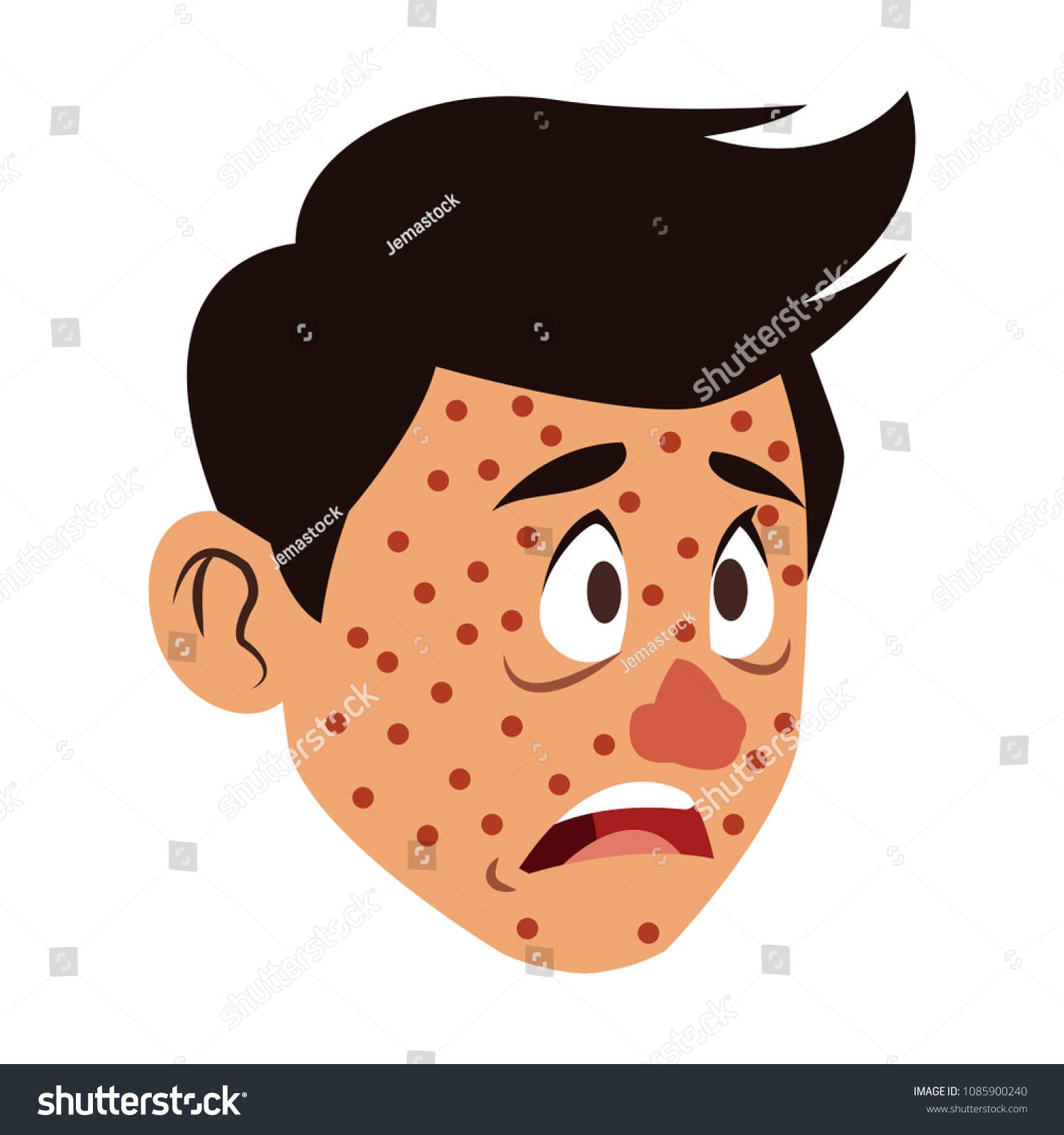 Man Face Chickenpox Stock Vector (Royalty Free) 1085900240 | Shutterstock