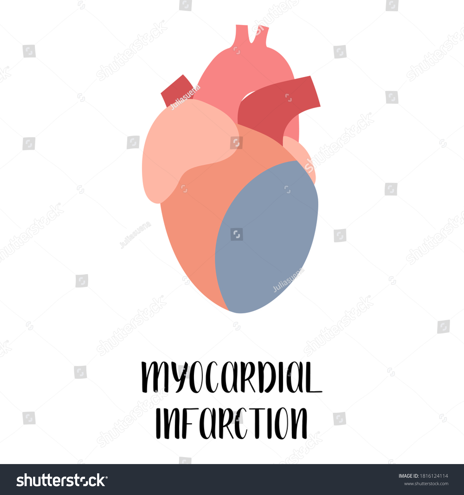 Myocardial Infarction Heart Cardiovascular Disease Cardiology Stock