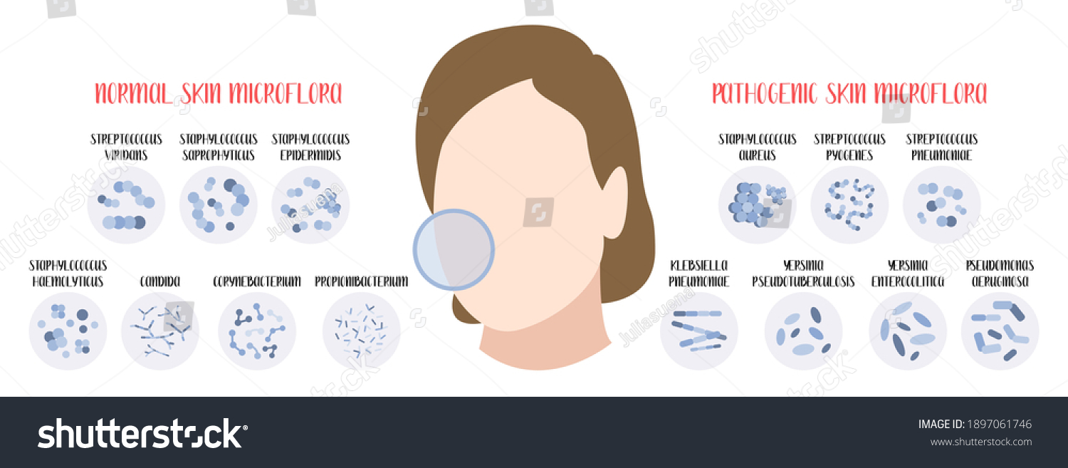 Normal Pathogenic Skin Microflora Bacteria Microbiome: เวกเตอร์สต็อก ...
