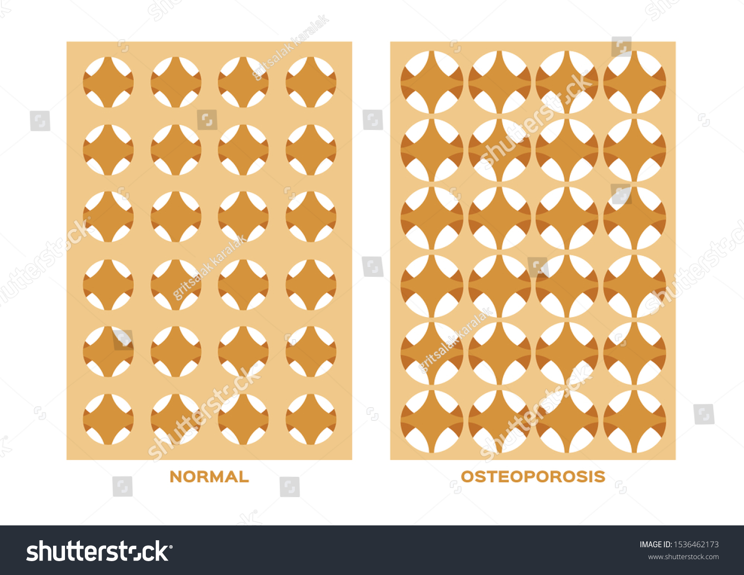 Osteoporosis Strong Bone Background Vector Stock Vector (Royalty Free ...