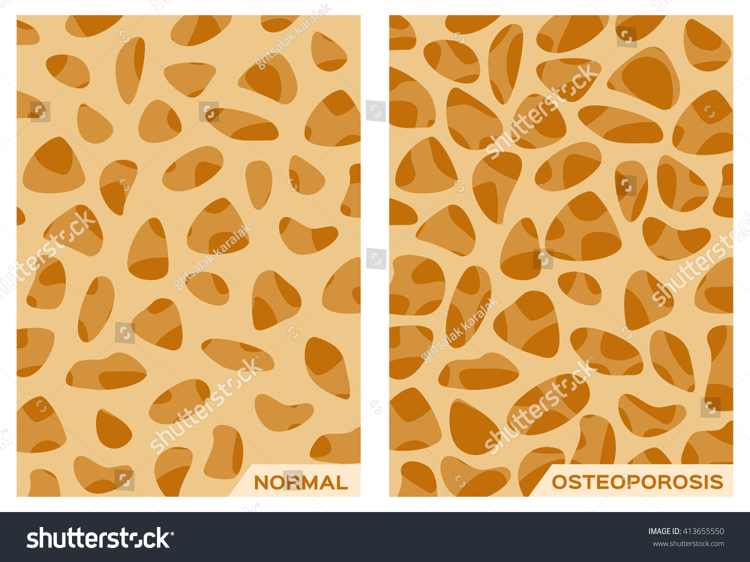 Osteoporosis Strong Bone Background Vector Stock Vector (Royalty Free ...