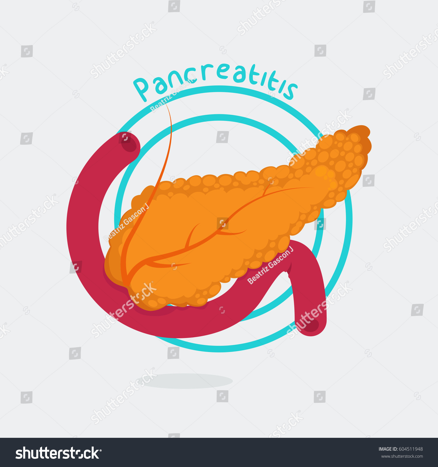Pancreatitis Vector Illustration Stock Vector (Royalty Free) 604511948