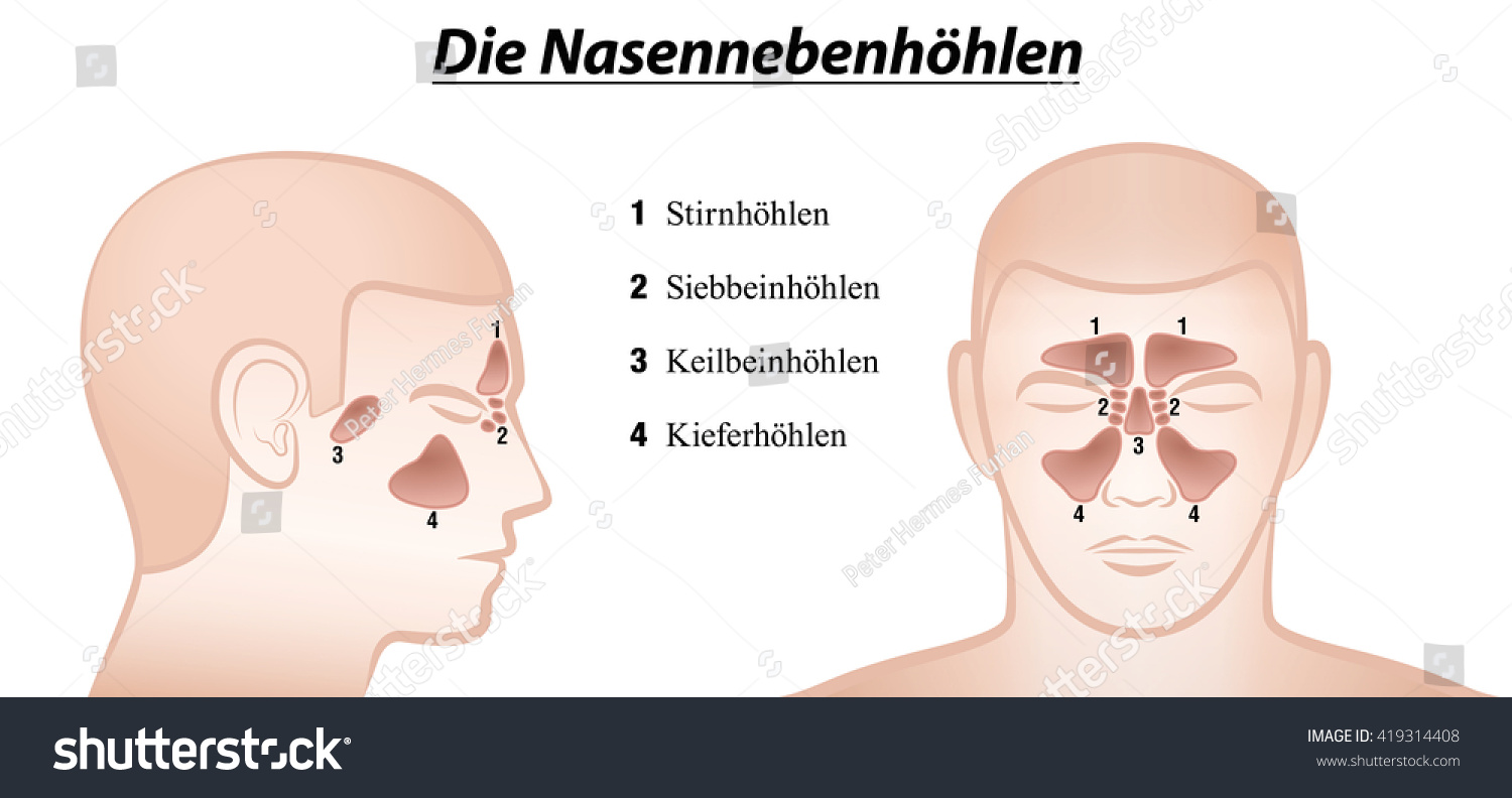 Paranasal Sinuses Anterior Lateral View German 库存矢量图(免版税)419314408 Shutterstock
