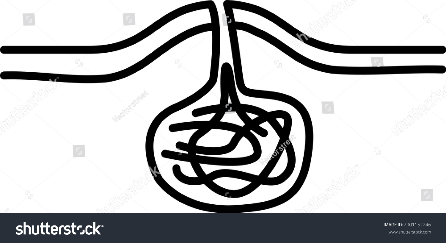 Pilonidal Cyst Icon Vector Illustration Stock Vector (Royalty Free ...