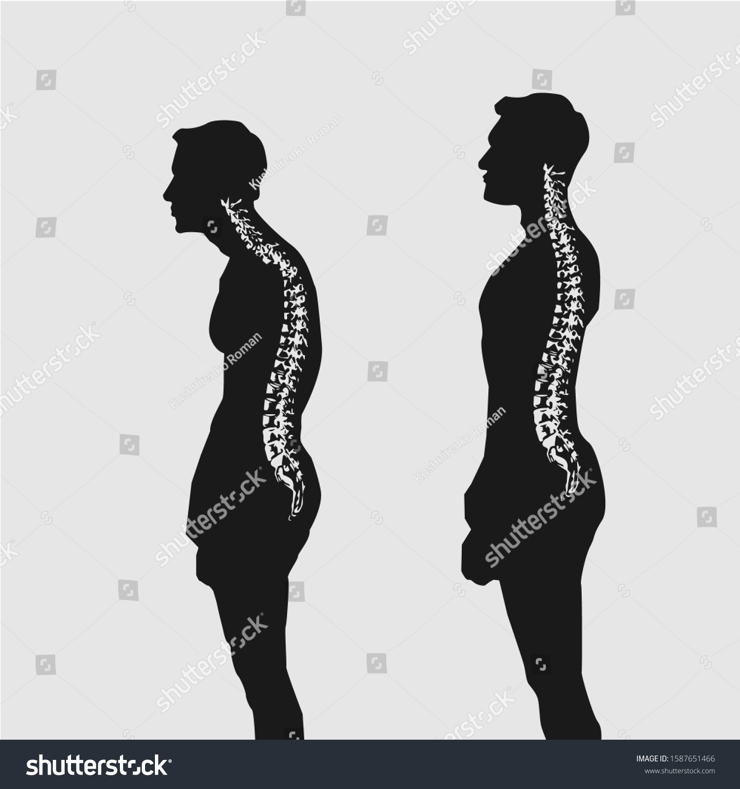 Posture Spine Bone Care Good Stock Vector (Royalty Free) 1587651466 ...