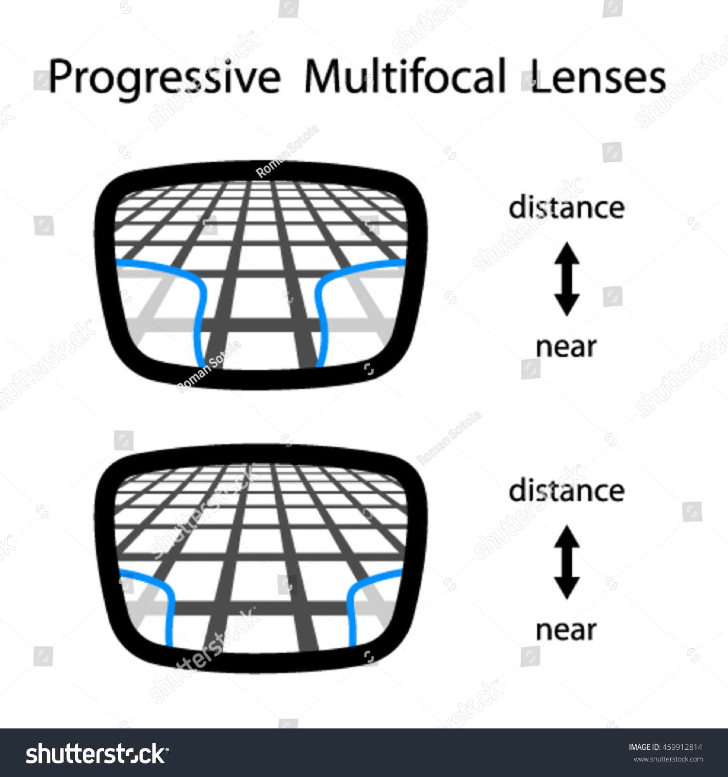 vectorial de lentes multifocal progresivas: vector de stock (libre de ...