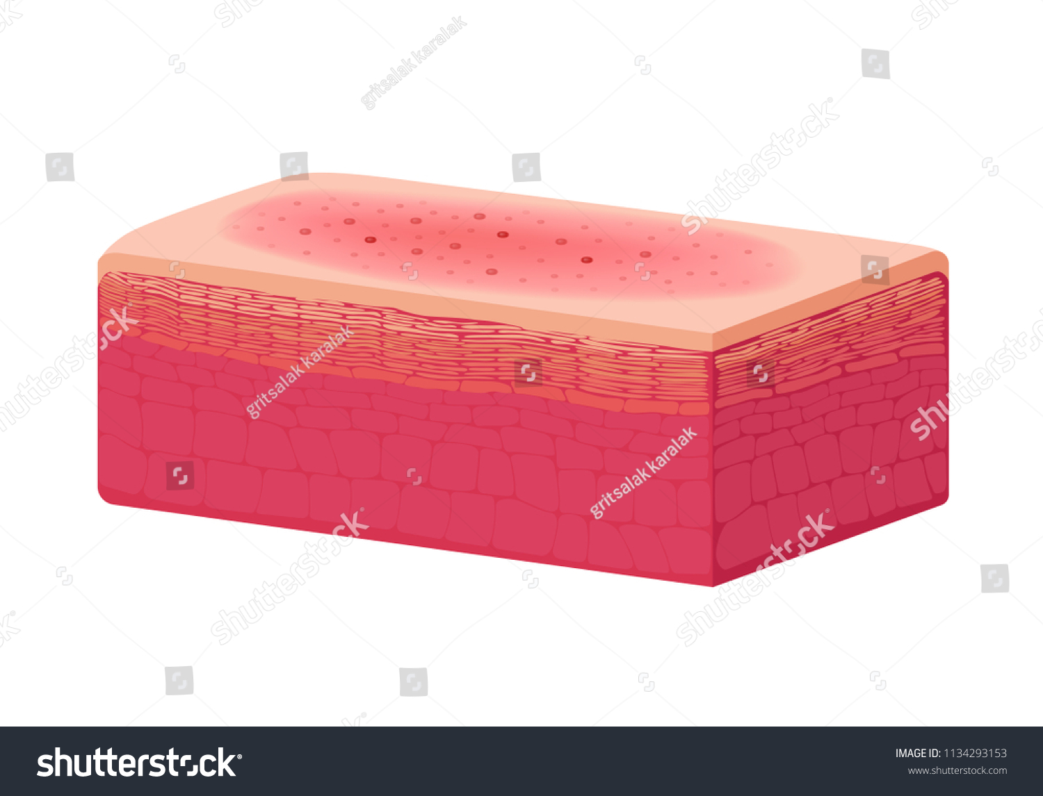 Rash On Skin Vector Stock Vector (Royalty Free) 1134293153 | Shutterstock