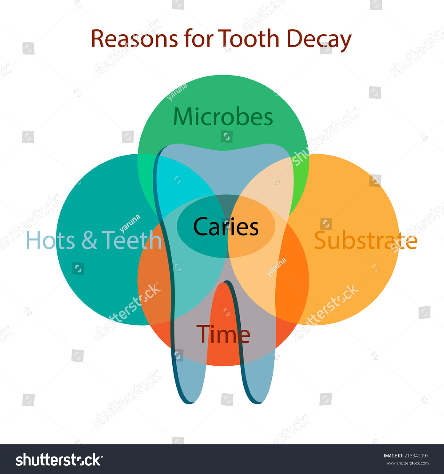 Reasons Tooth Decay Stock Vector (Royalty Free) 213342997