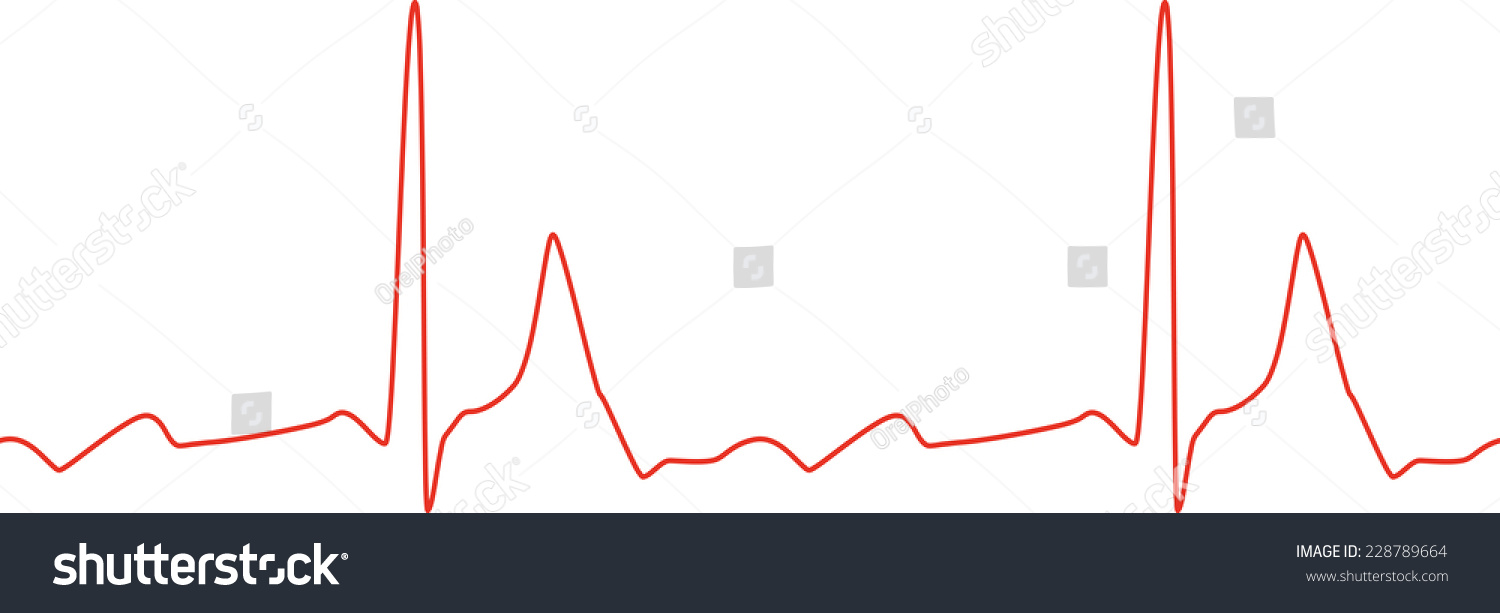 Seamless Ecg Graph On White Background Stock Vector (Royalty Free ...